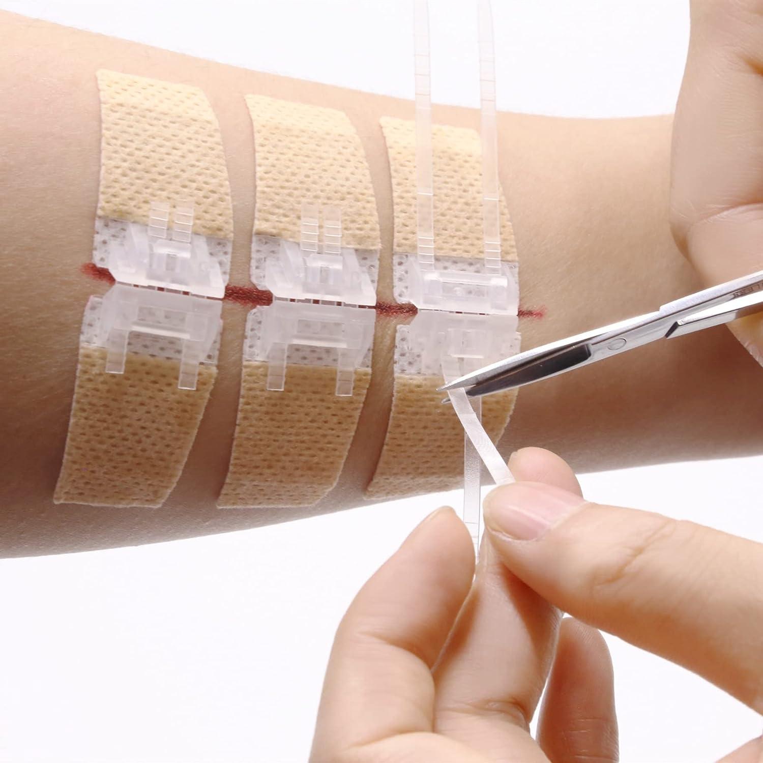 Longmed Emergency Wound Closures - Butterfly Adhesive Bandages - 3 ...