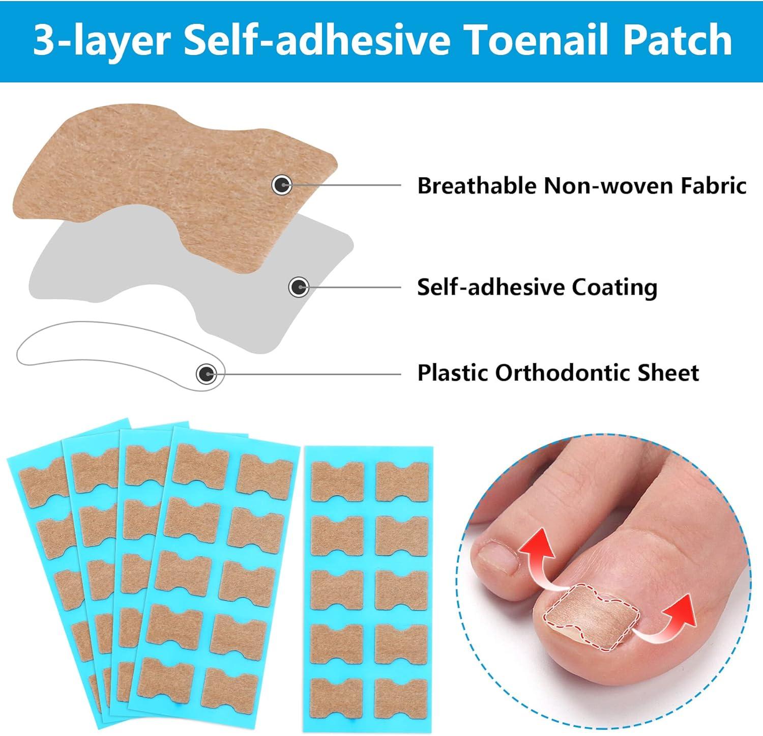 SANNIX Ingrown Toenail Tool Set with 100 Pieces Correction Patches ...