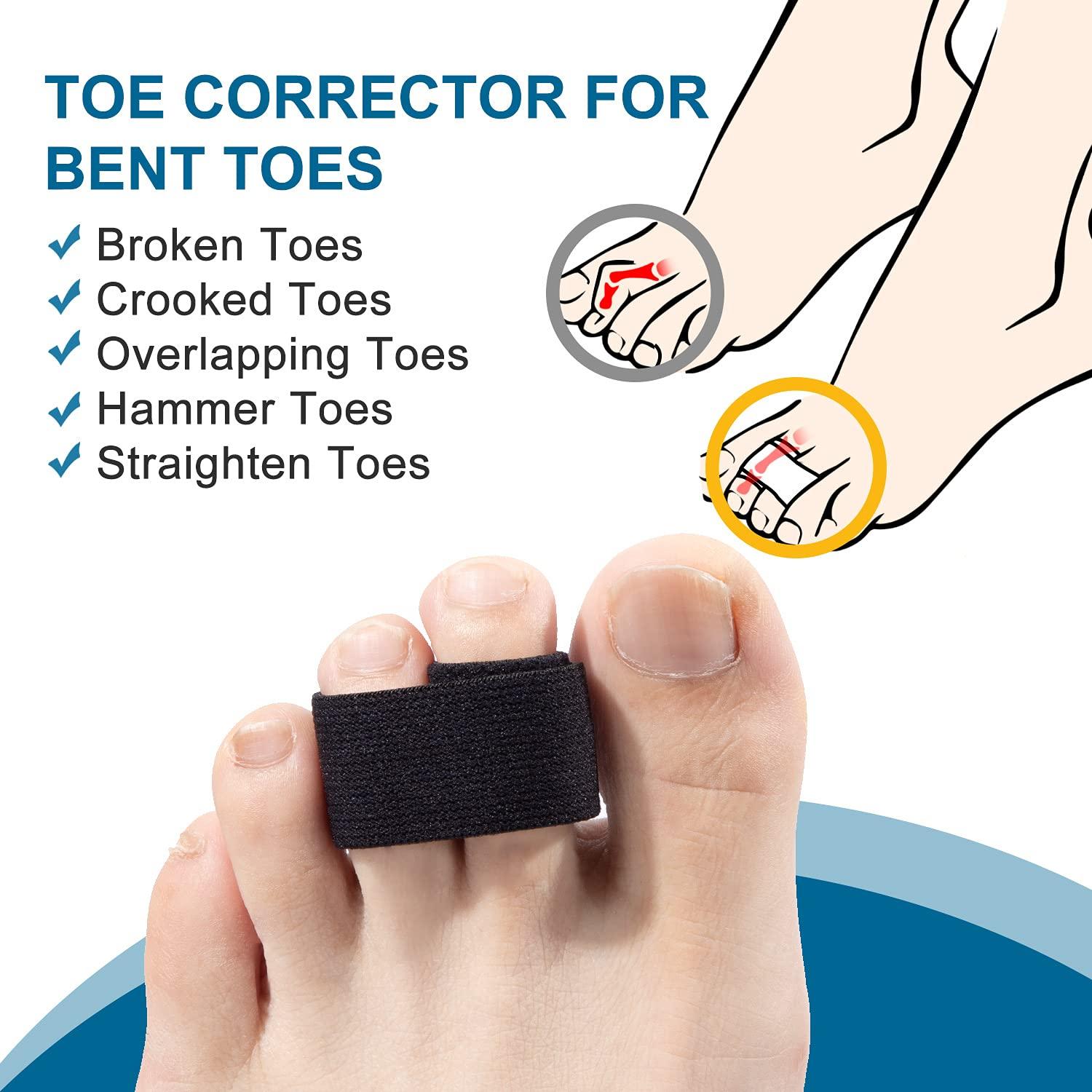 Kimihome Toe Splints - Corrector for Overlapping Toe, Hammer & Crooked ...