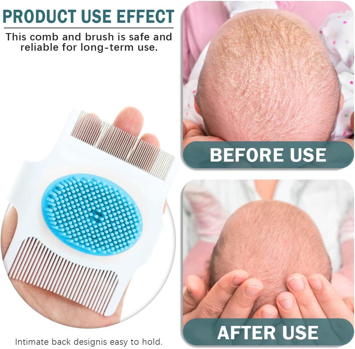 Baby Cradle Cap Comb - 2 Pcs Dandruff Cleaning Brush with Soft Rubber ...