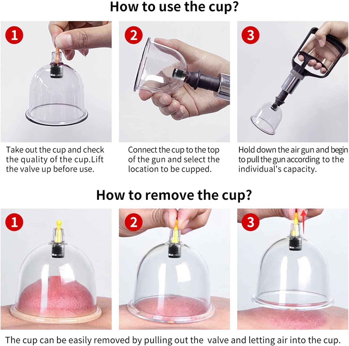 Cupping Therapy Set 32 Cups with Pump - Professional Chinese Acupoint ...