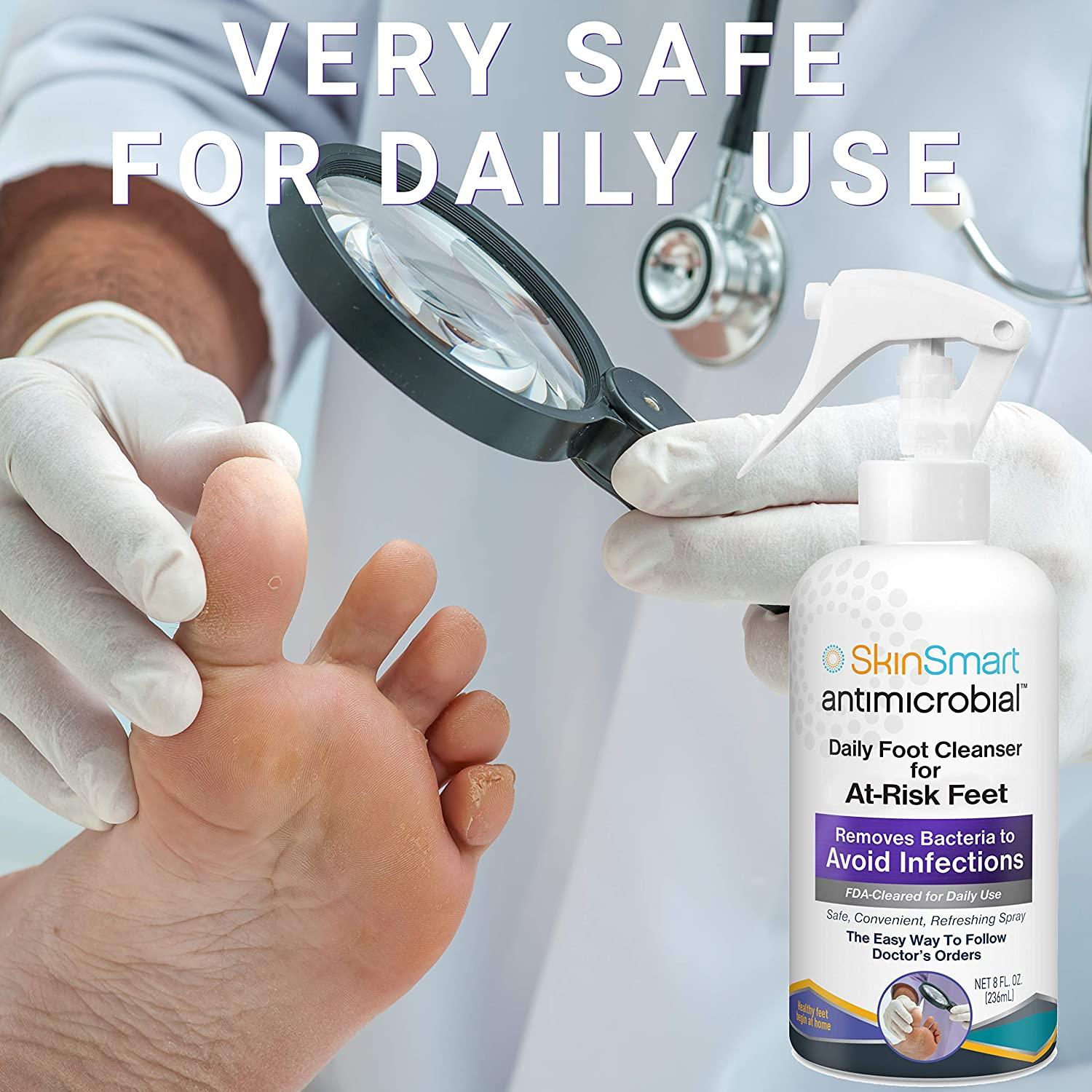 SkinSmart Daily Foot Cleanser - 8oz Spray | Removes Bacteria, Prevents ...