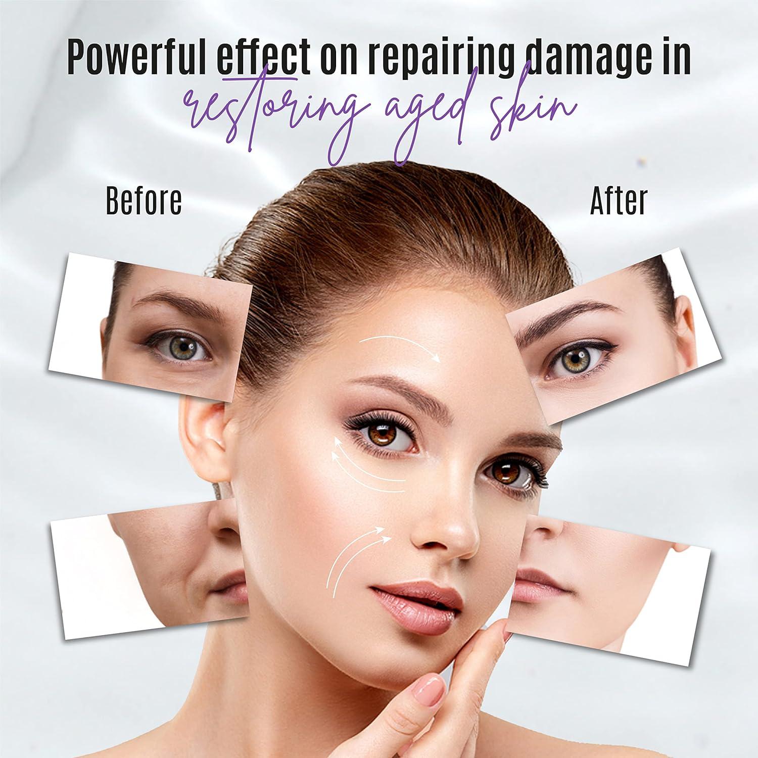 30% Matrixyl 3000 Face Cream - Anti-Aging Skin Elasticity Repair with ...