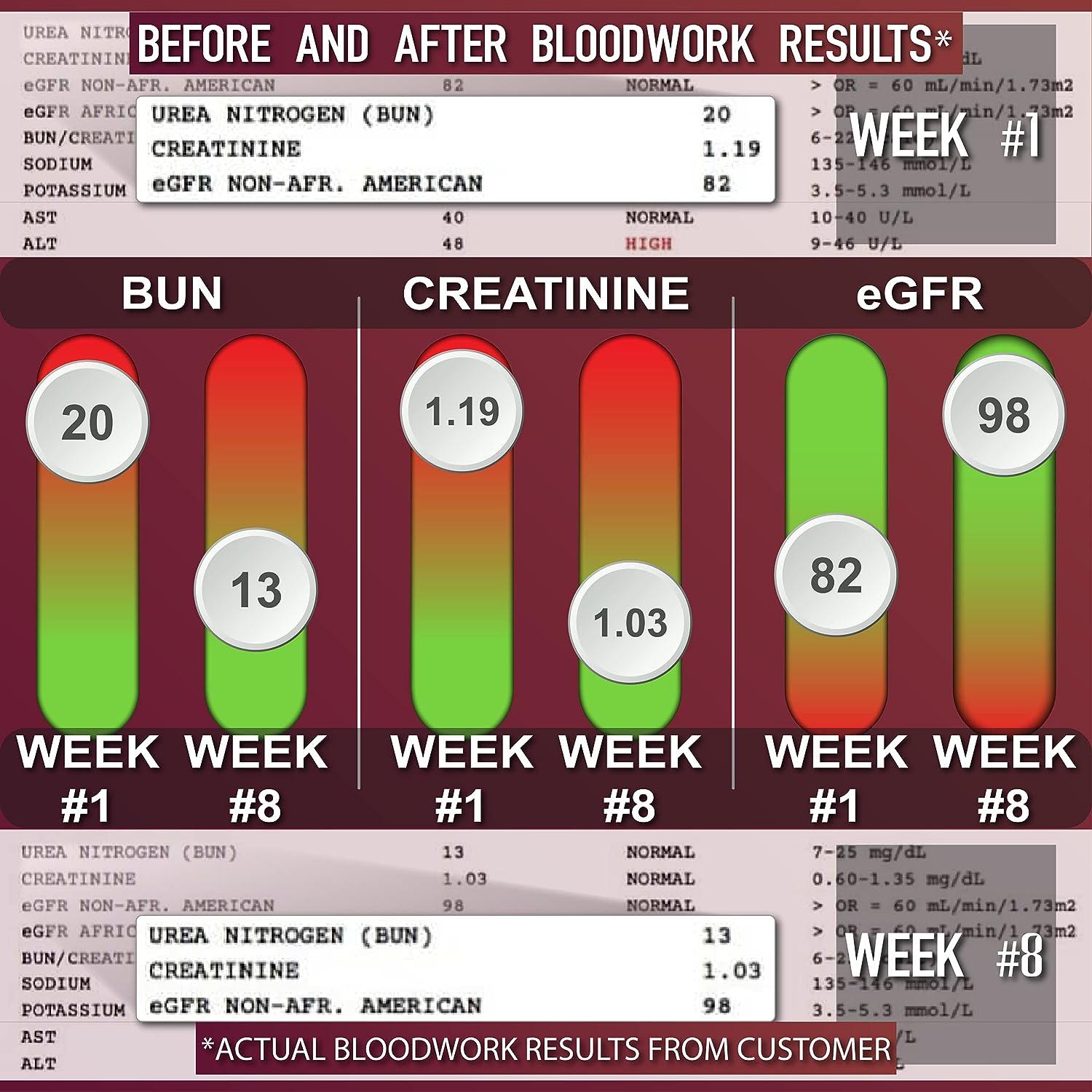 Leviathan Super Kidney Cleanse & Urinary Detox Formula - Optimal Kidney ...