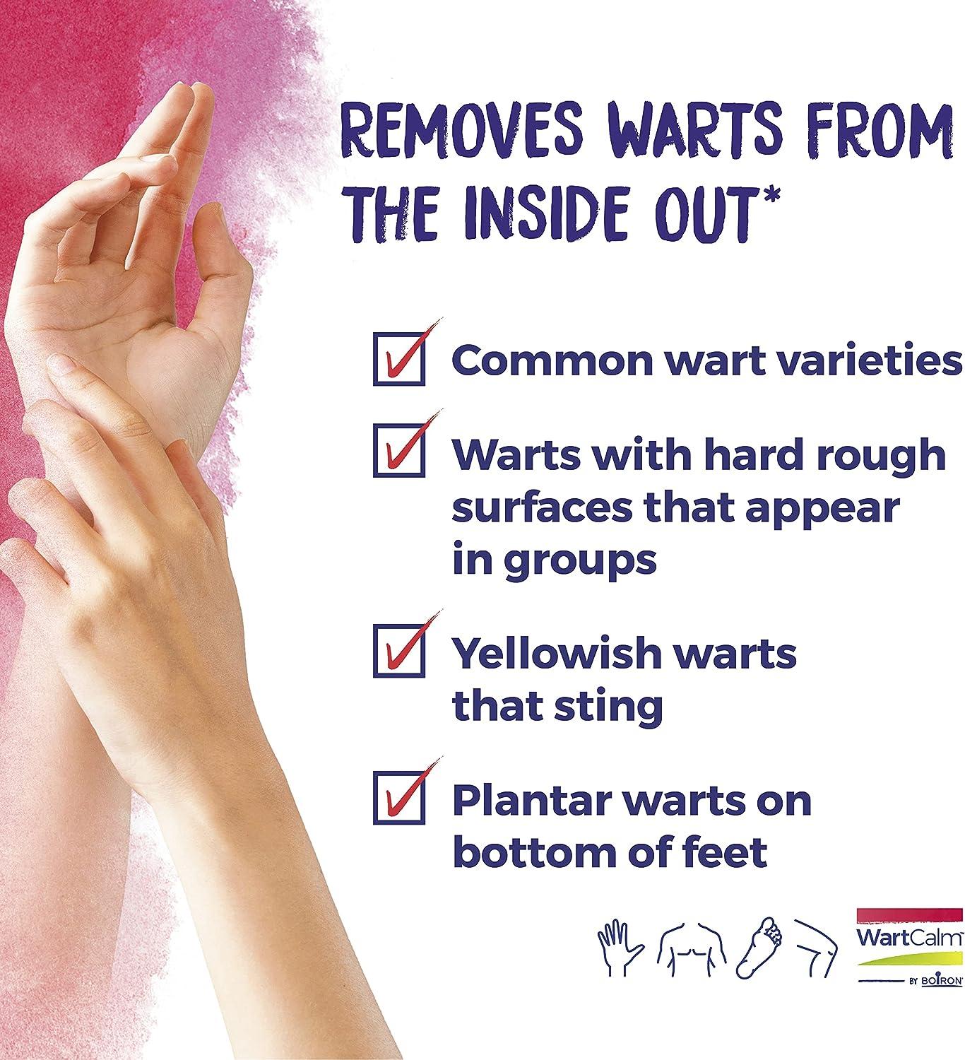 Boiron WartCalm: Painless Wart Removal for Hands, Knees, Feet, & Body ...