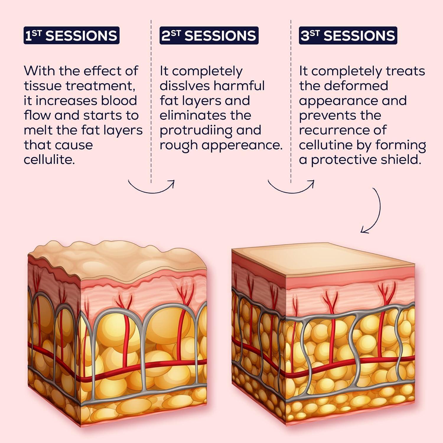 LAPULITA Anti Cellulite Spray - Natural Formula for Firming Legs, Hips ...