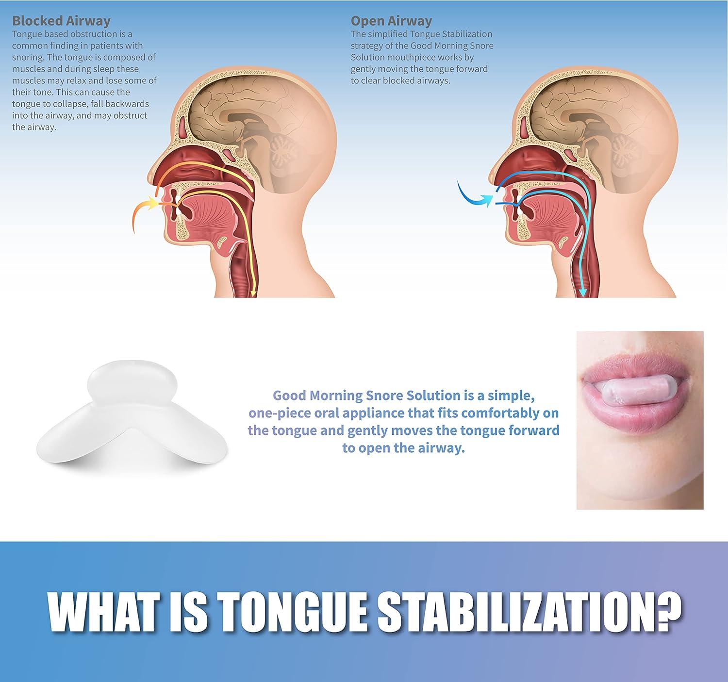 Good Morning Snore Solution Mouthpiece - FDA Cleared Anti Snoring ...