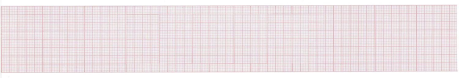 Contec 80A ECG Chart Paper 50mm X 20m - Pack of 10 Rolls | Buy Now with ...