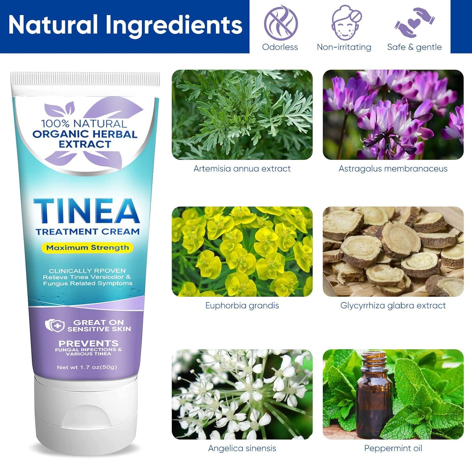 Tinea Versicolor Natural Skin Cream - Effective Treatment for All Skin ...