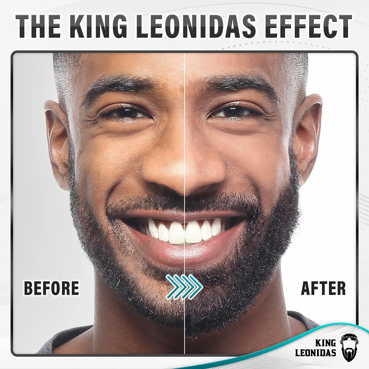 leonidas beard shape
