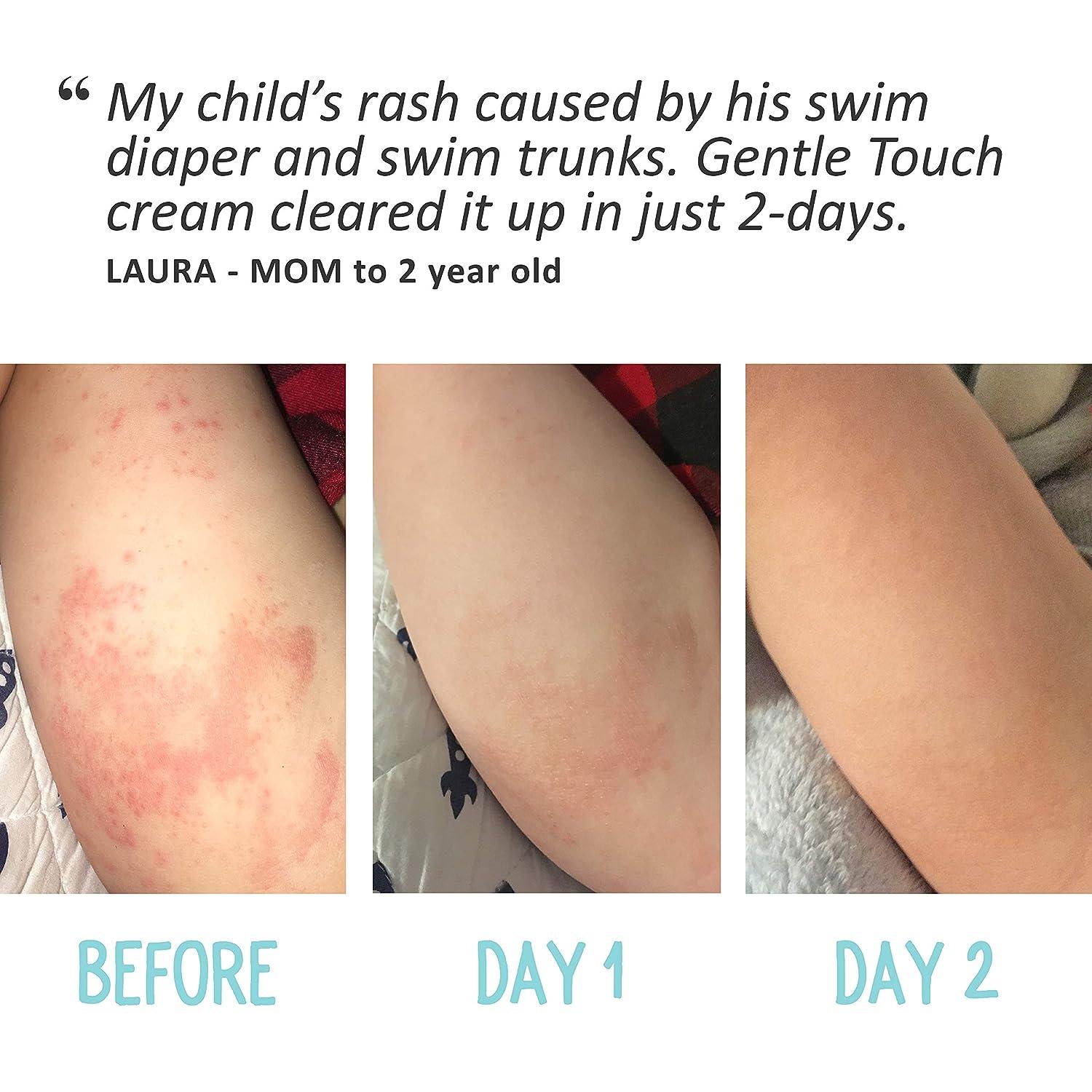 Baby & Kids Moisturizing Cream for Sensitive Skin - Eczema, Psoriasis ...
