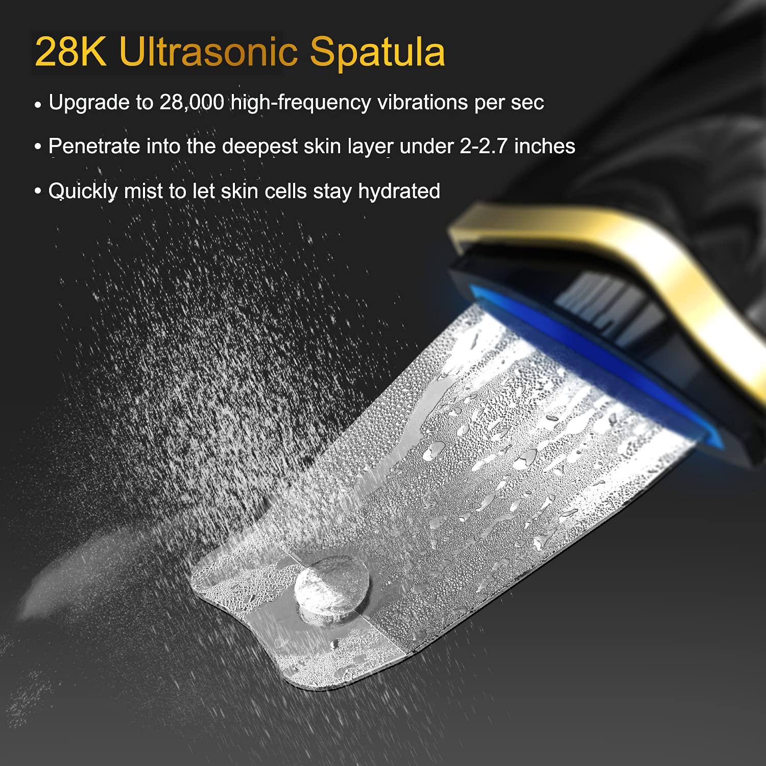 Qukot Ultrasonic Skin Scrubber Spatula - Blue-Light Upgraded Blackhead ...