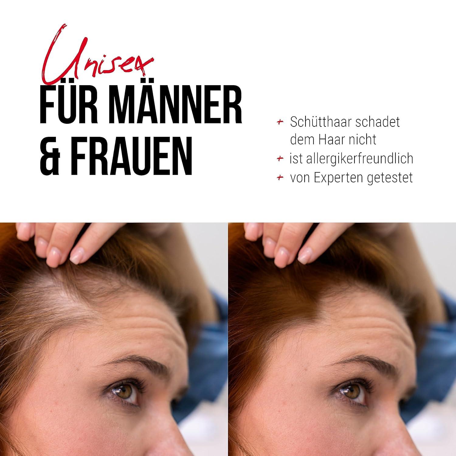 Hair Effect - Instant Full Hair Solution | Premium 26g Dark Brown Stray ...