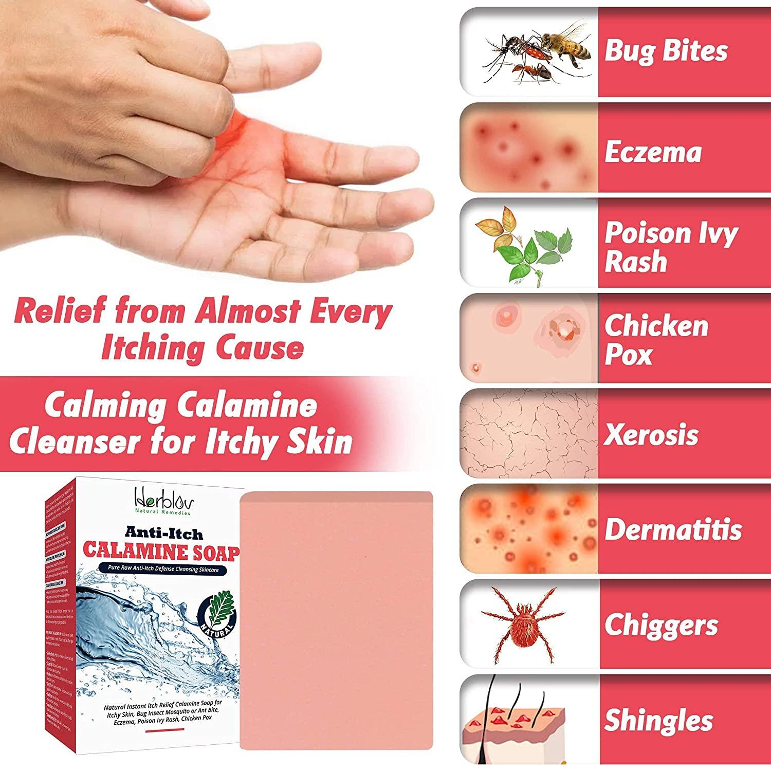 Bug Bite Itch Relief Calming Calamine Soap For Instant Itch Relief ...