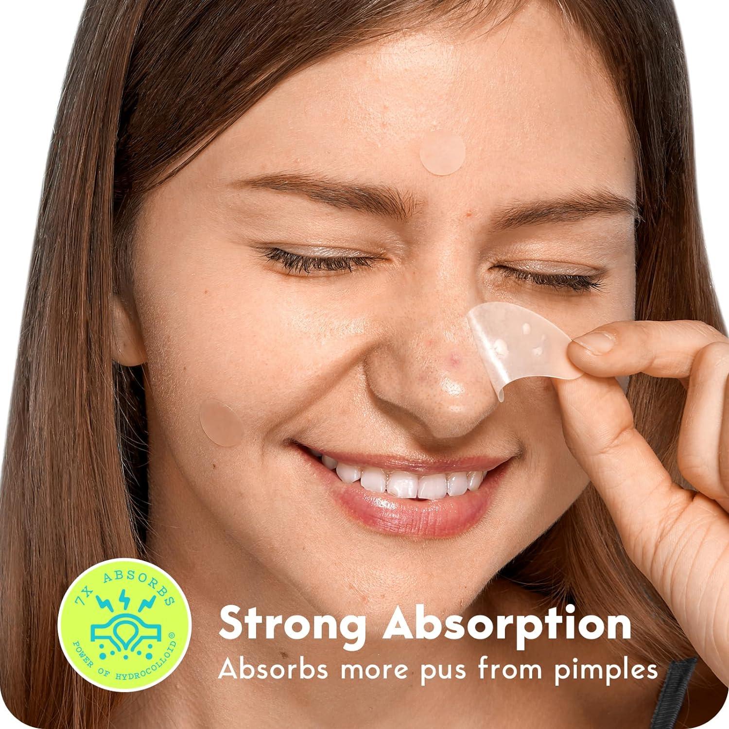 LitBear 84 Patches - Large Hydrocolloid Acne Patches with Tea Tree Oil ...