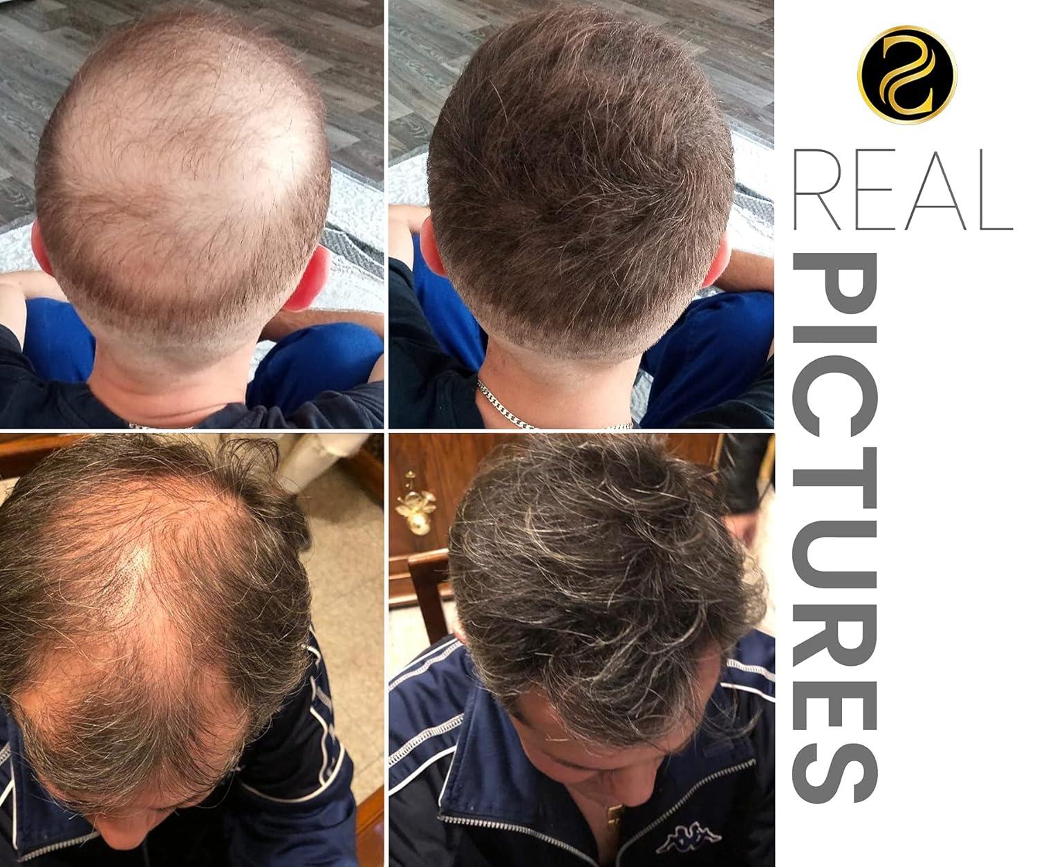 Illusya Hair Compression - Premium Medium Brown Hair Filler | Full Hair ...