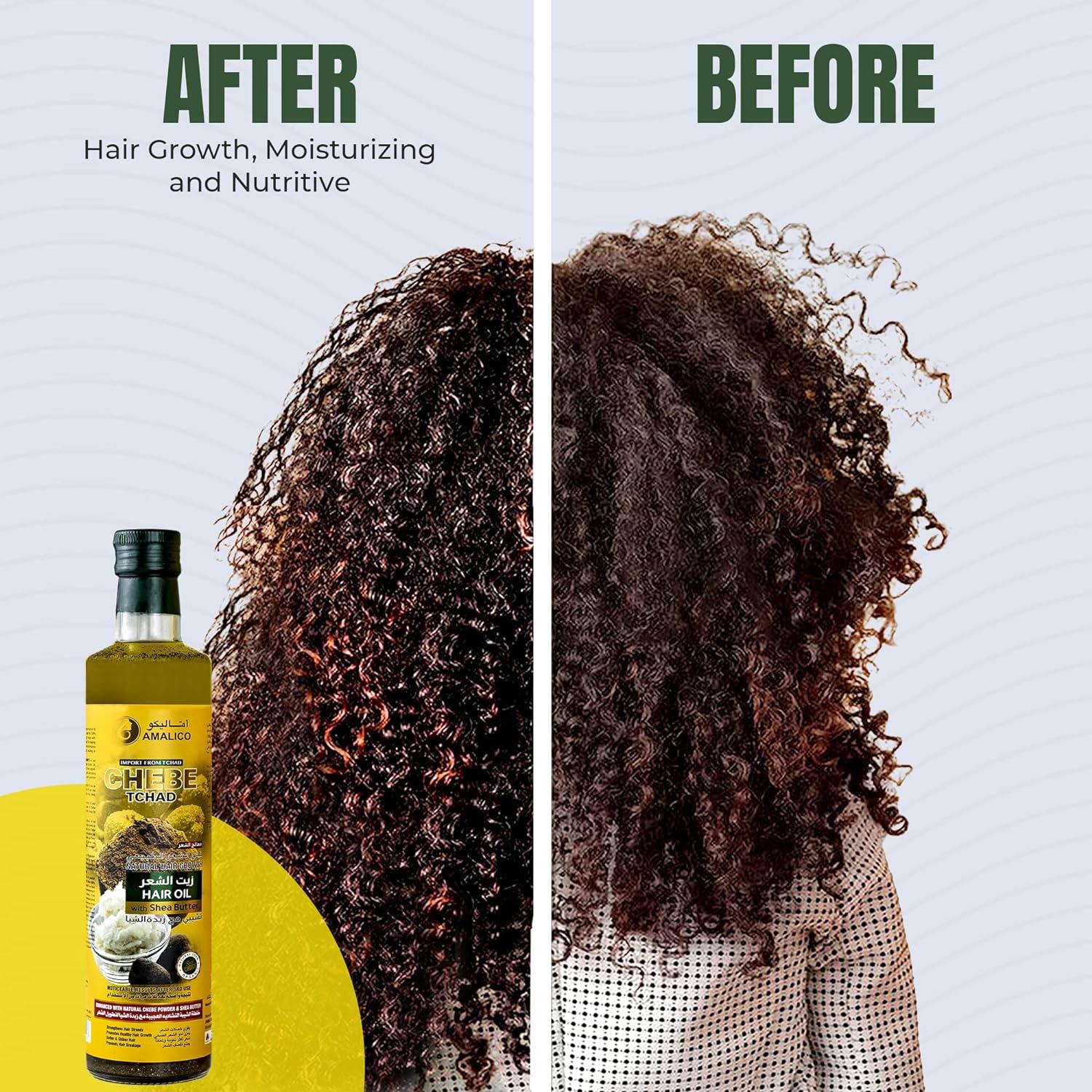 Amalico Chebe Hair Growth Oil 8.45 fl. Oz. - Organic Solution for ...