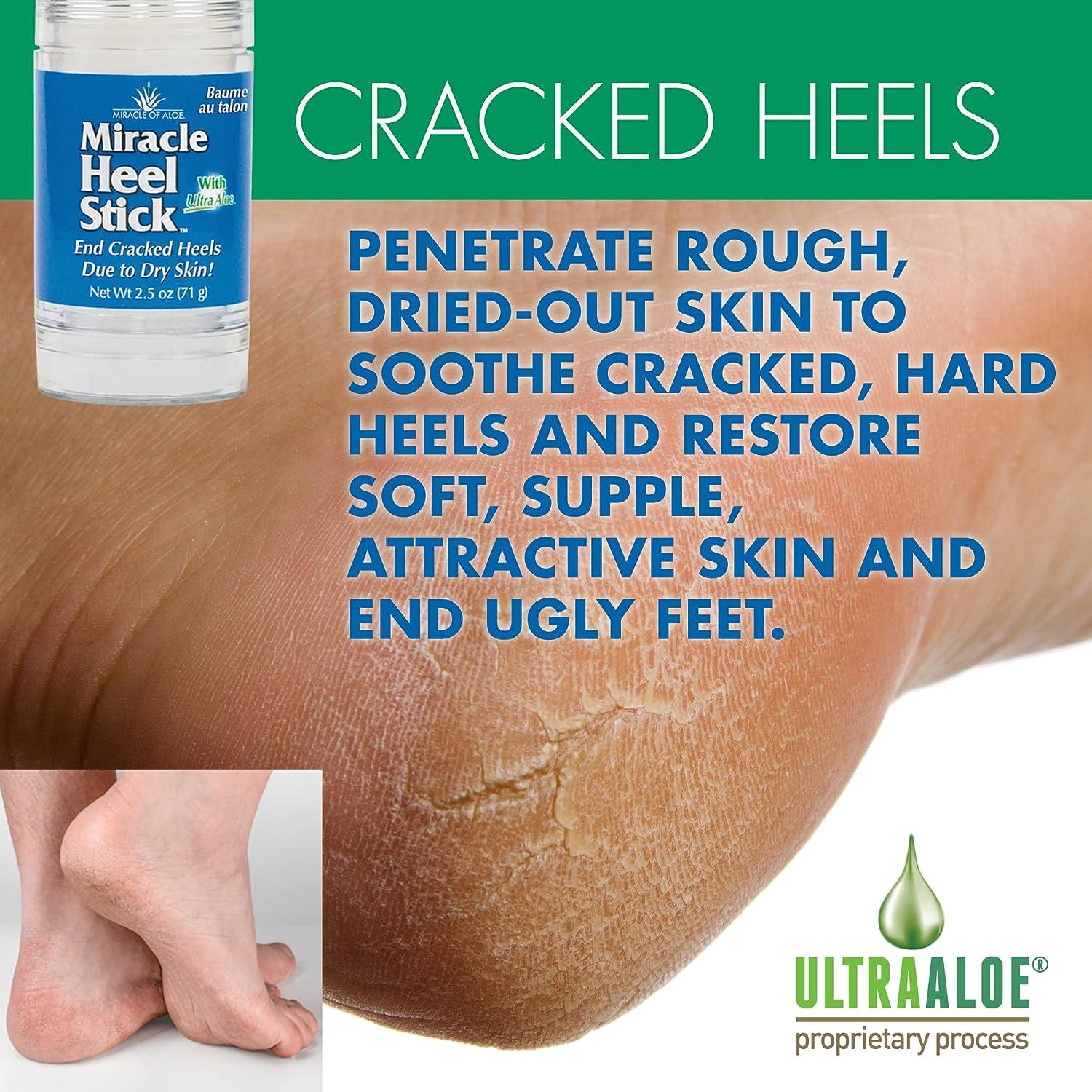 Miracle Heel Stick 2.5 oz & Foot Repair 1 oz | Pure UltraAloe Gel ...