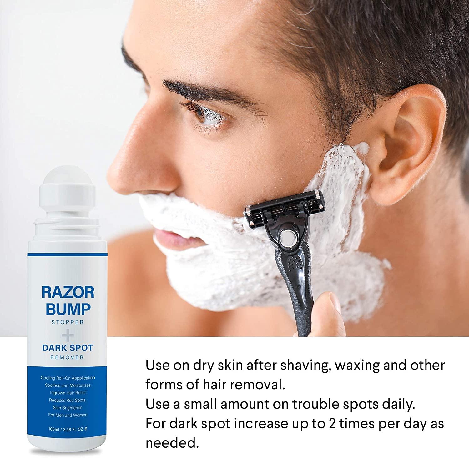 Razor Bump Stopper & Dark Spot Remover: Ingrown Hair Treatment for Men ...
