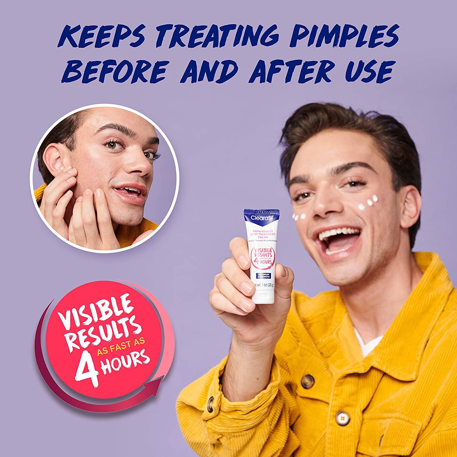 Clearasil Rapid Rescue Spot Treatment Cream 1 oz - Fast Acne Relief ...