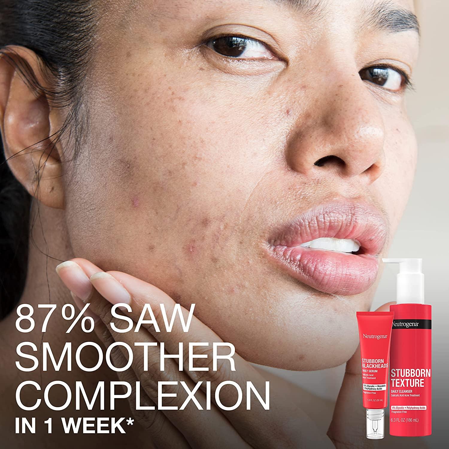 Neutrogena Stubborn Texture Daily Cleanser - Fragrance-Free 6.3 fl oz ...