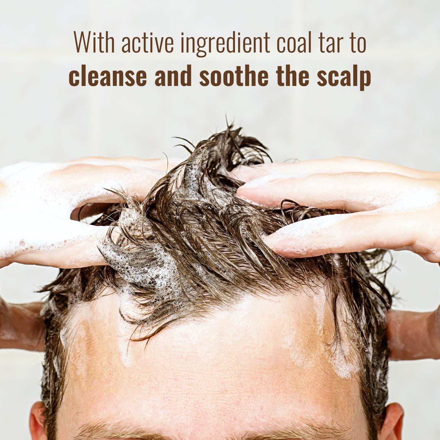 Poltar Scalp Shampoo 150ml - Treats Psoriasis, Seborrhoeic Dermatitis ...