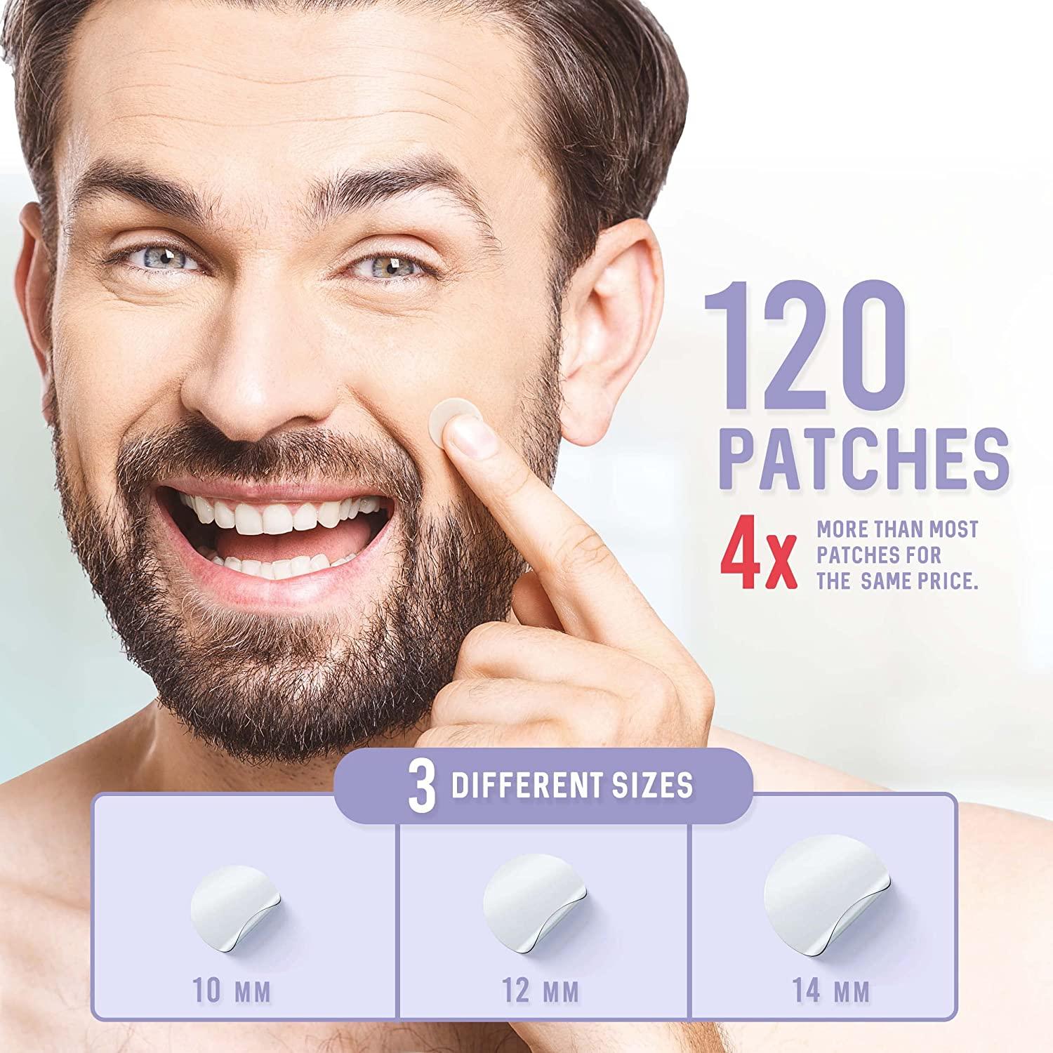 KEYCONCEPTS Pimple Patches (120 Pack) - Salicylic Acid and Tea Tree Oil ...