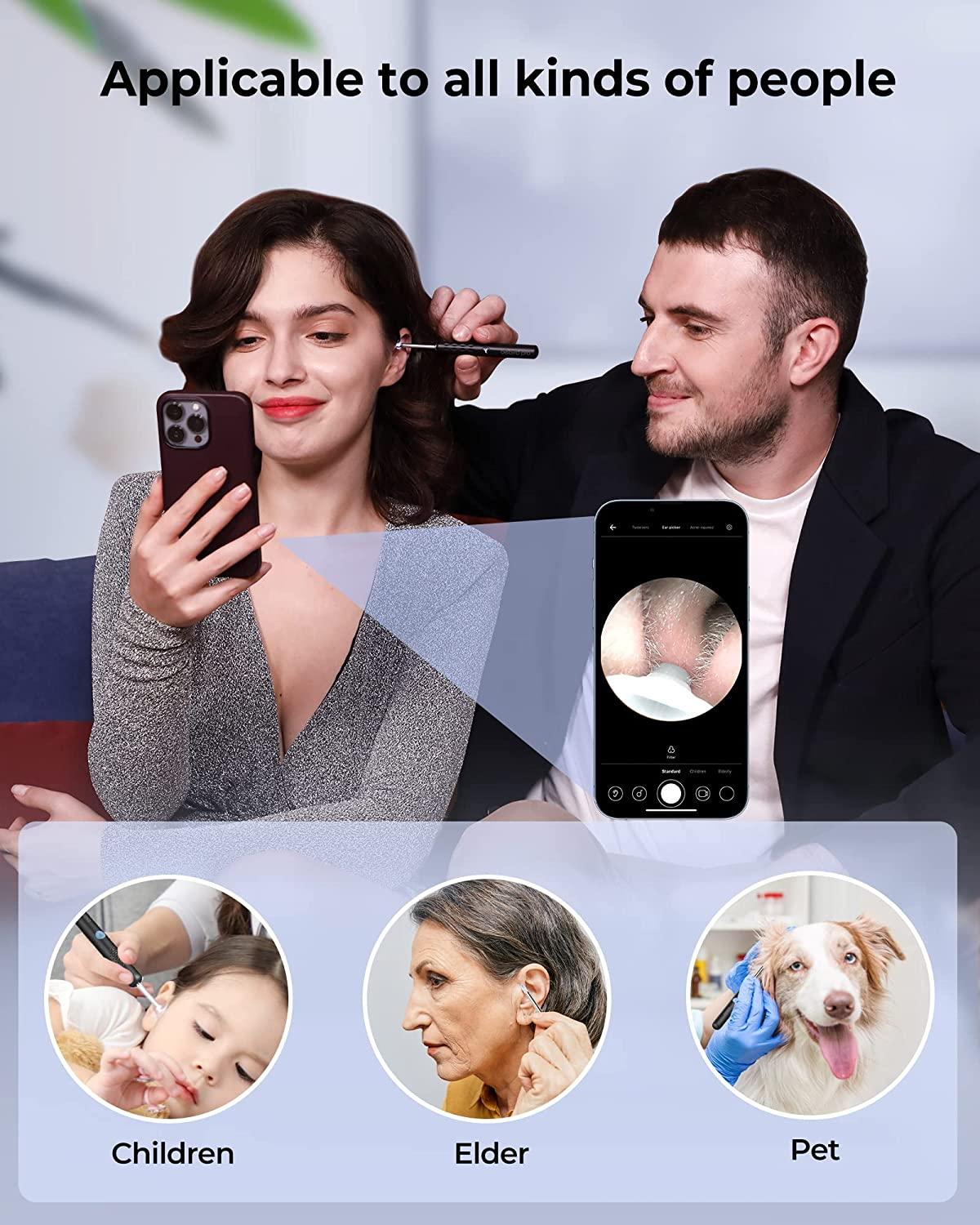 BEBIRD R1 Ear Wax Removal Tool with 1080P Otoscope, 2 Silicone Ear ...