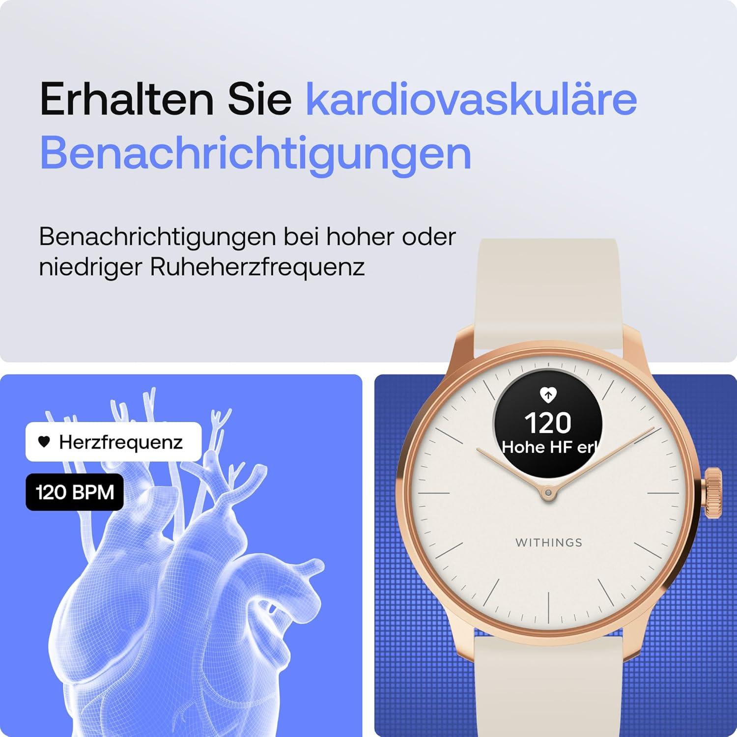 Withings Scanwatch Light - Hybrid Smartwatch with Heart Monitoring ...