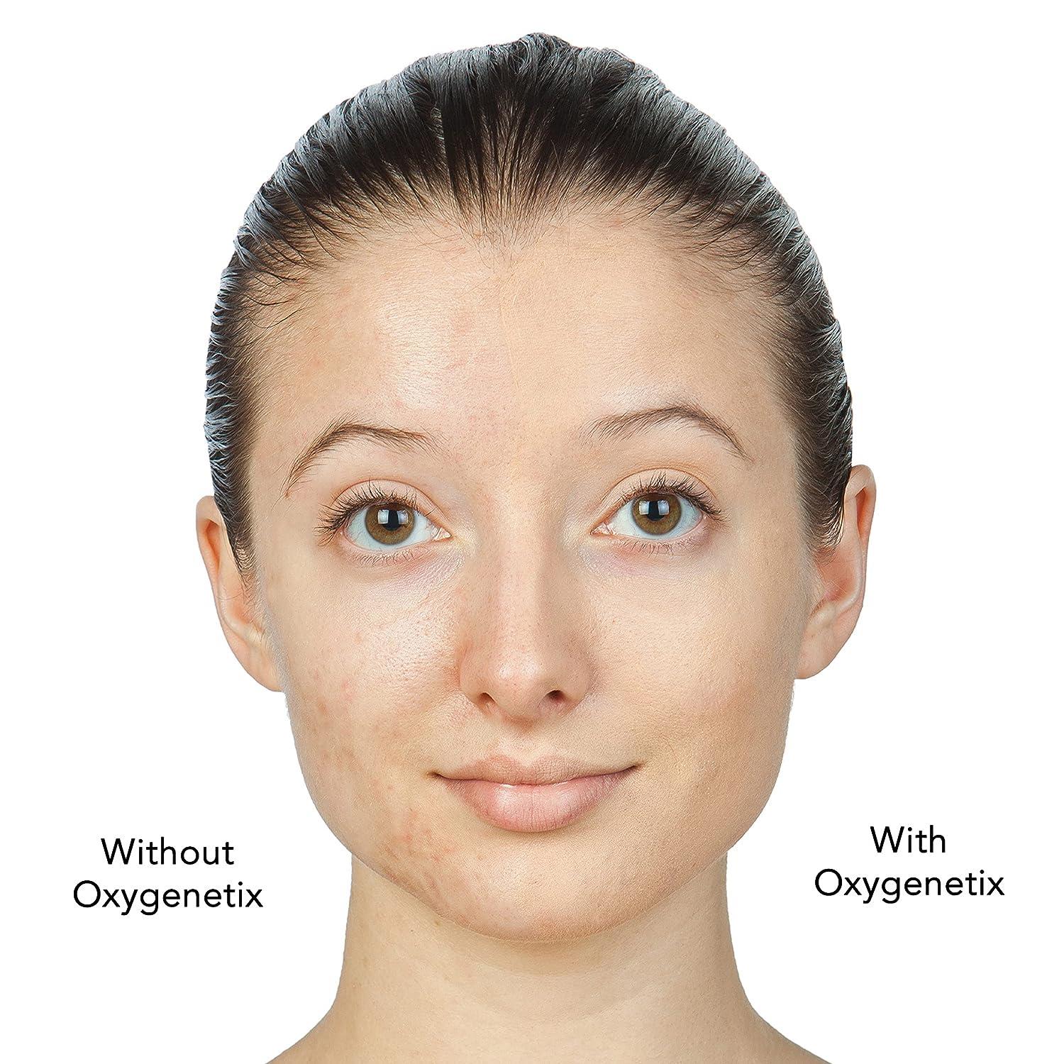 Oxygenetix Oxygenating Foundation 15ml Ivory - Breathable Coverage for ...