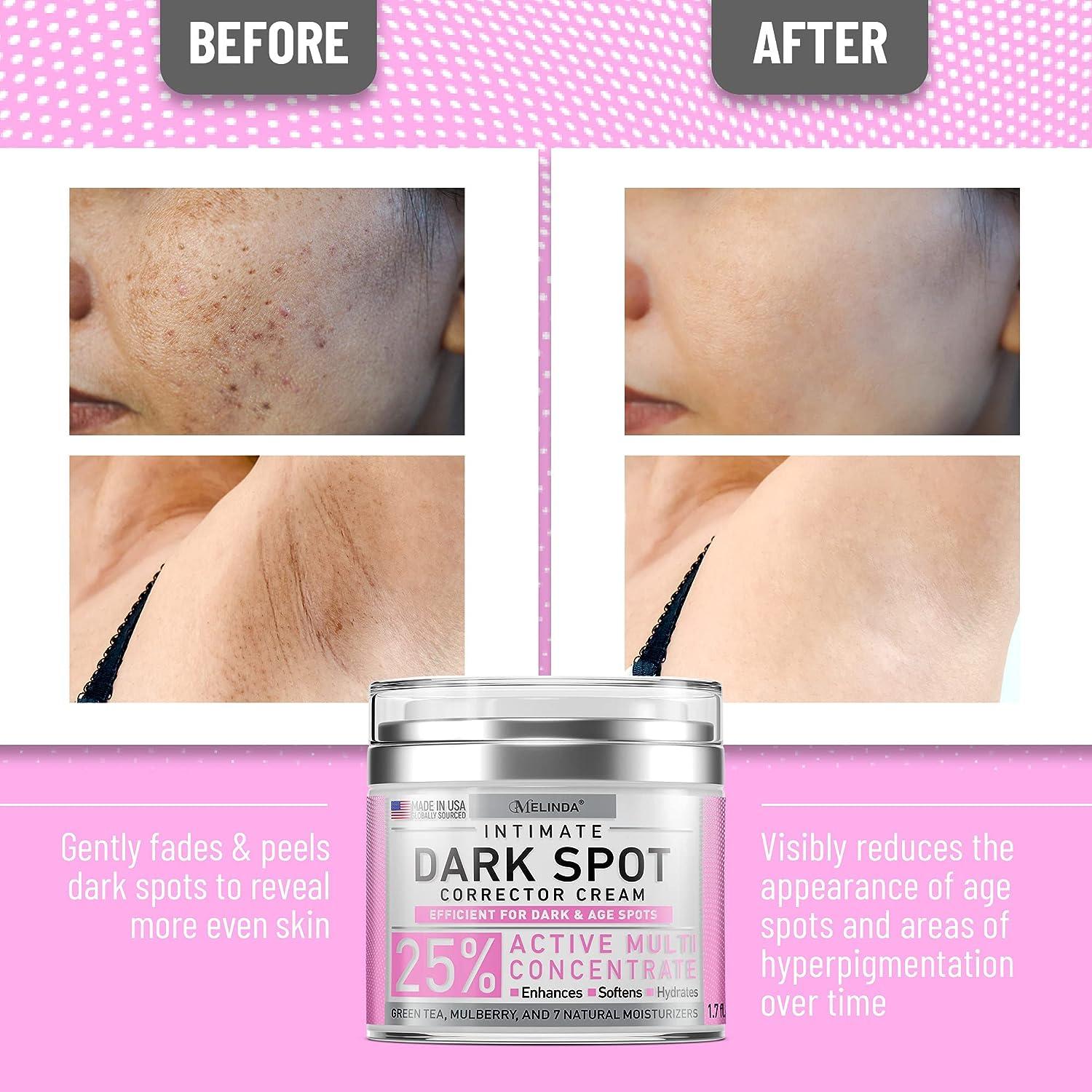Melinda Dark Spot Corrector Cream for Sensitive Areas - 1.7 Oz - USA ...