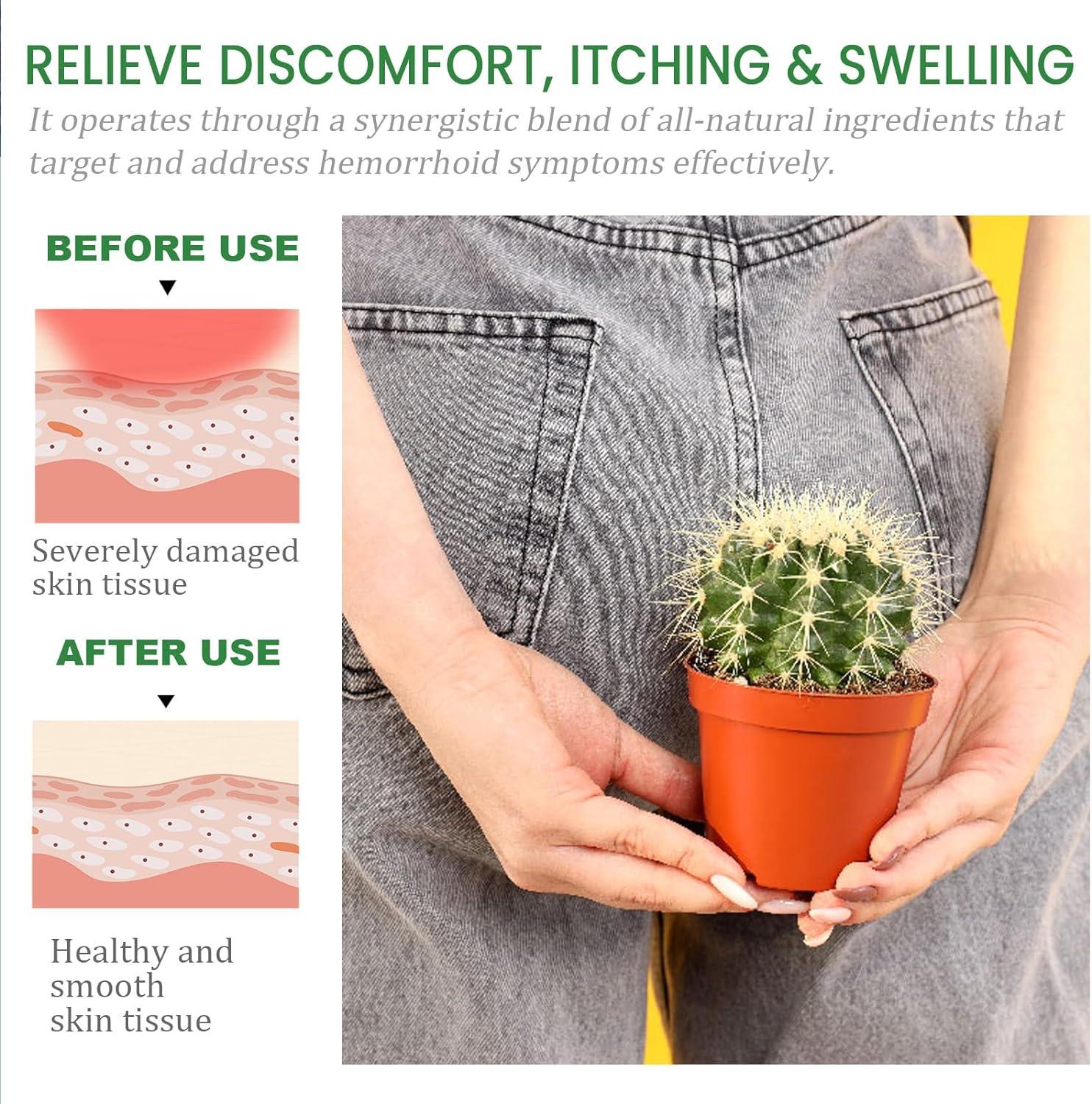 Natural Herbal Hemorrhoid Cream for Effective Piles Treatment & Pain ...