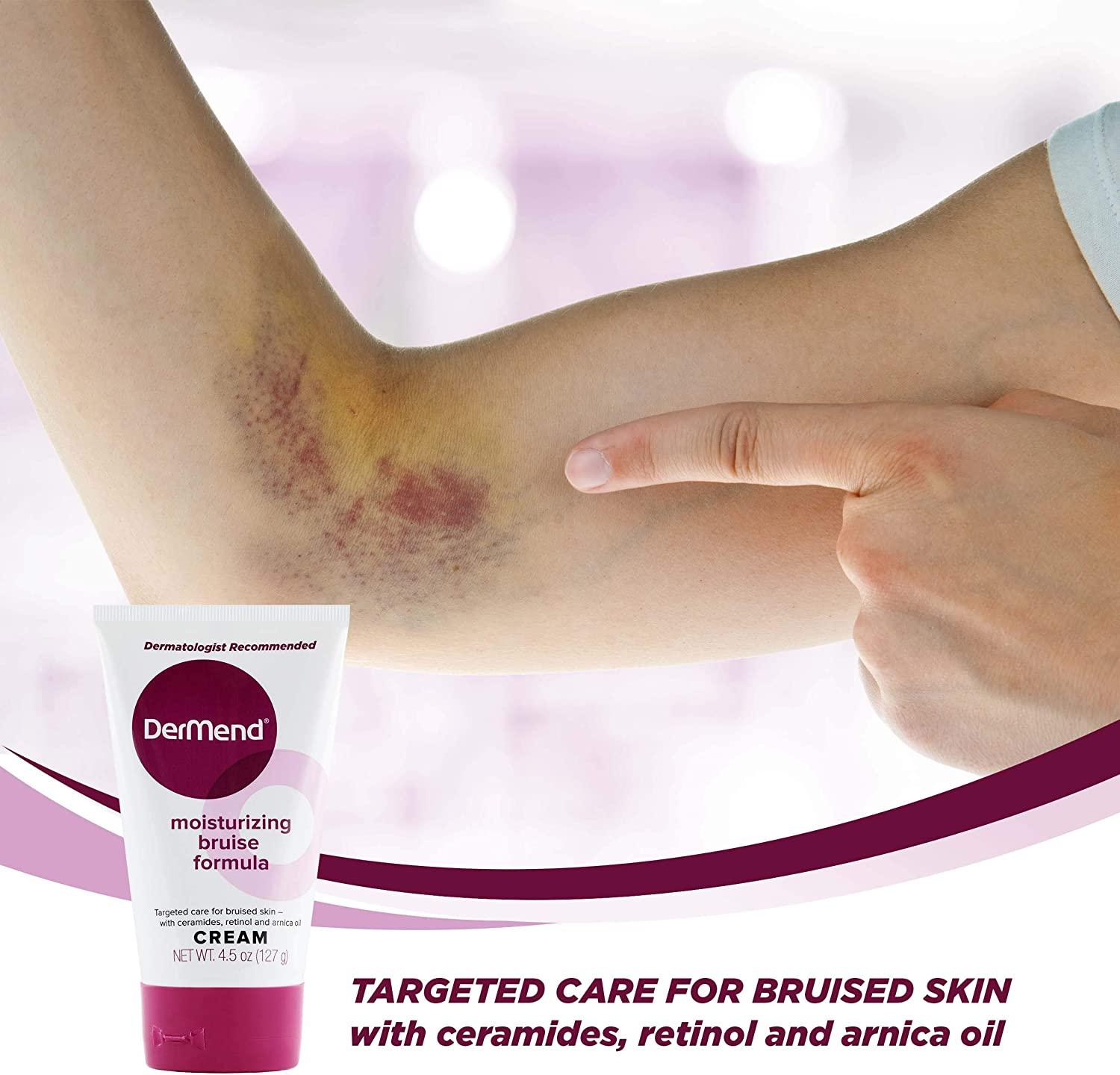 DerMend Arnica Montana Bruise Cream - Vitamin K Formula for Thin ...