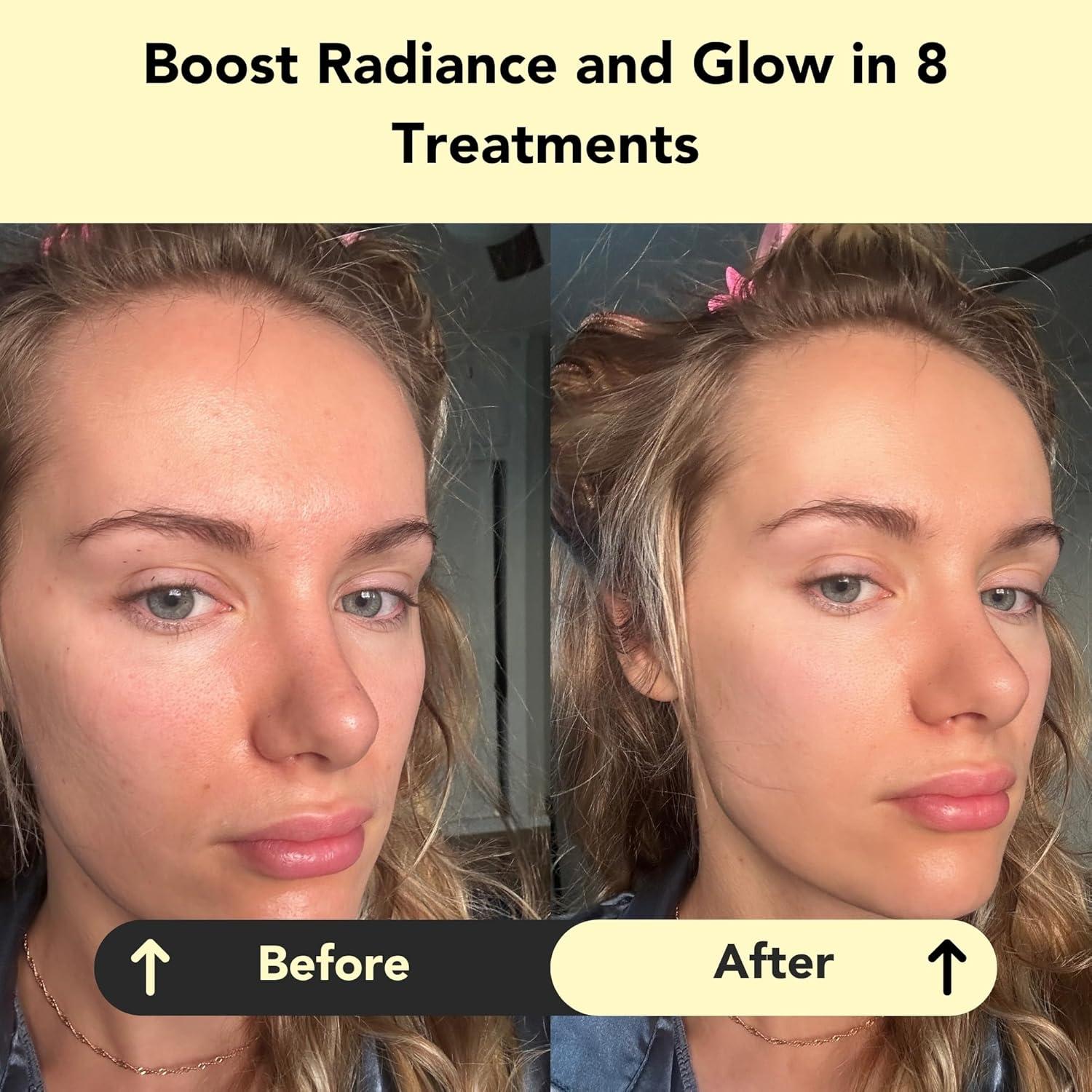Glorio GLOW: 8 Revitalizing Clay Face Masks - Boost Radiance ...