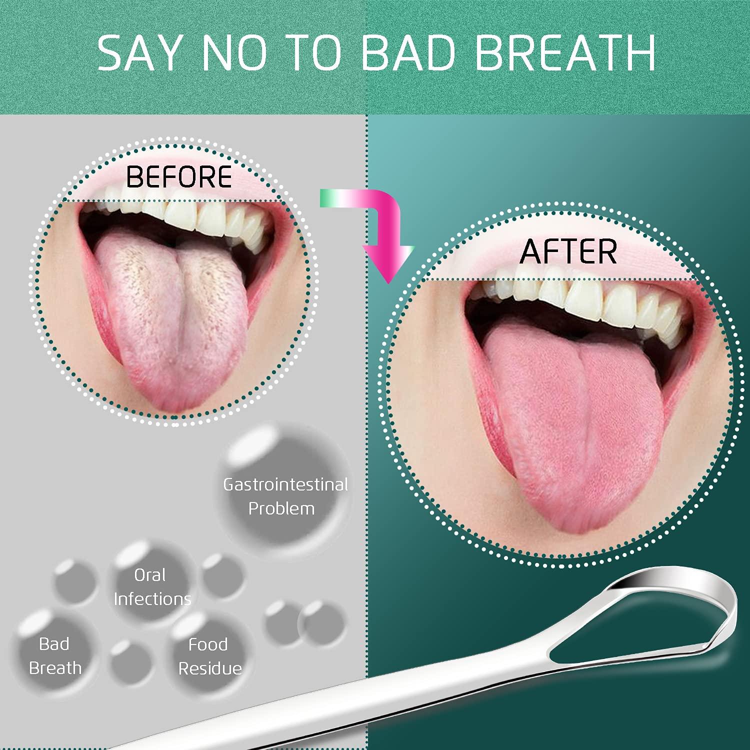3Pcs Medical Grade Stainless Steel Tongue Scrapers | Fight Bad Breath ...