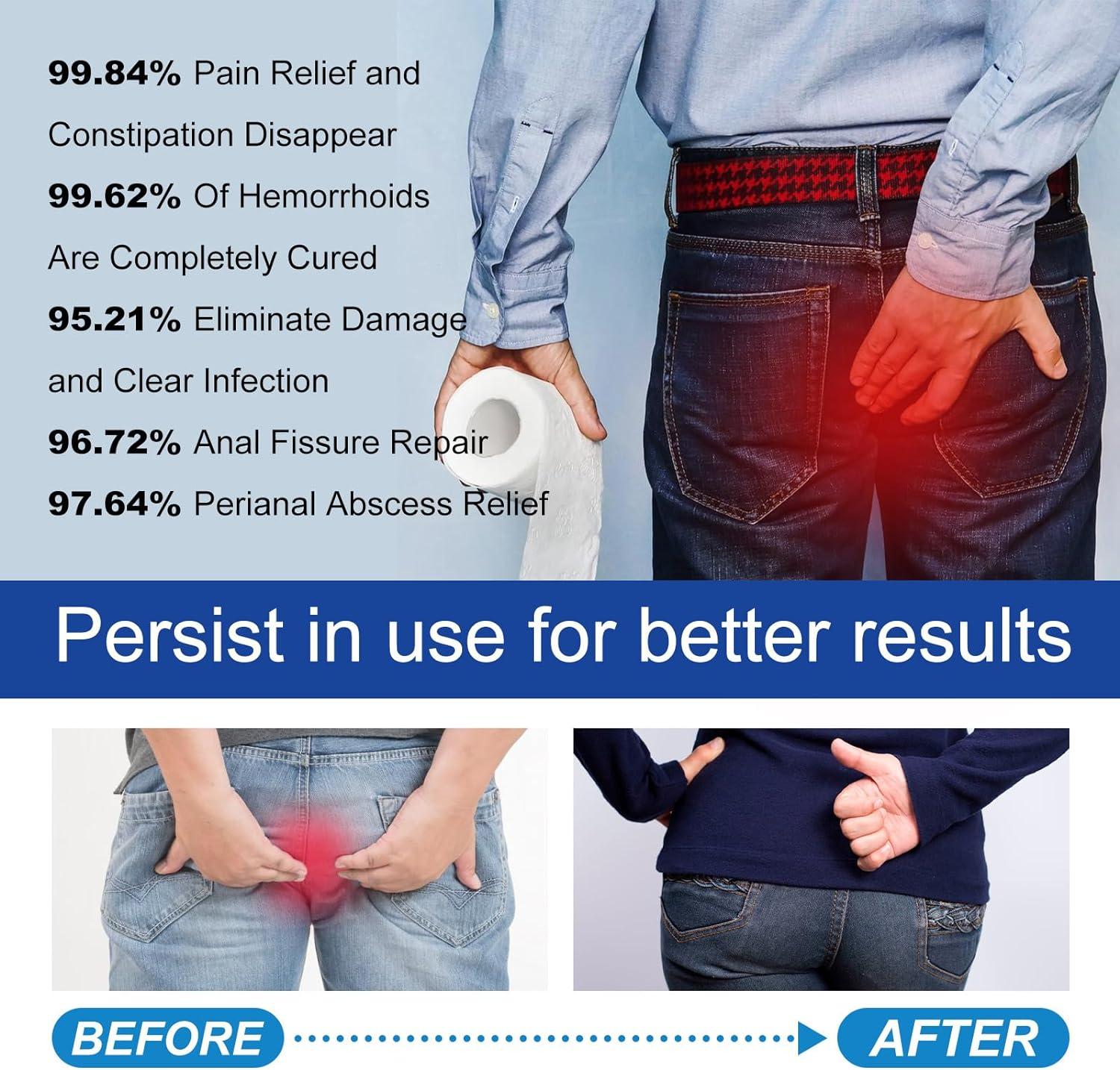 Heca Natural Herbal Hemorrhoid Capsules 7pc/Box - Rapid Relief ...
