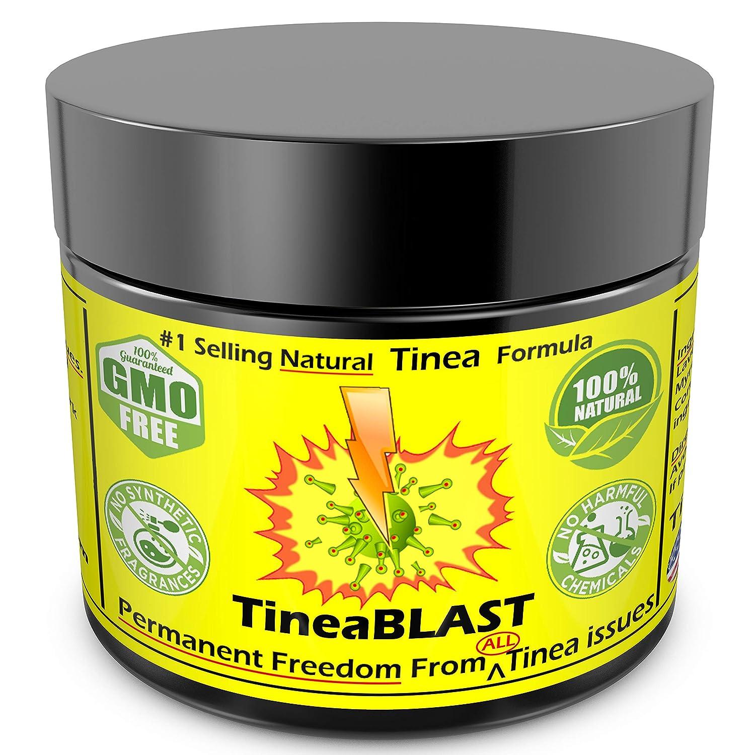 Best Tinea Versicolor Treatment Cream: Fast Relief for Tinea Pedia ...