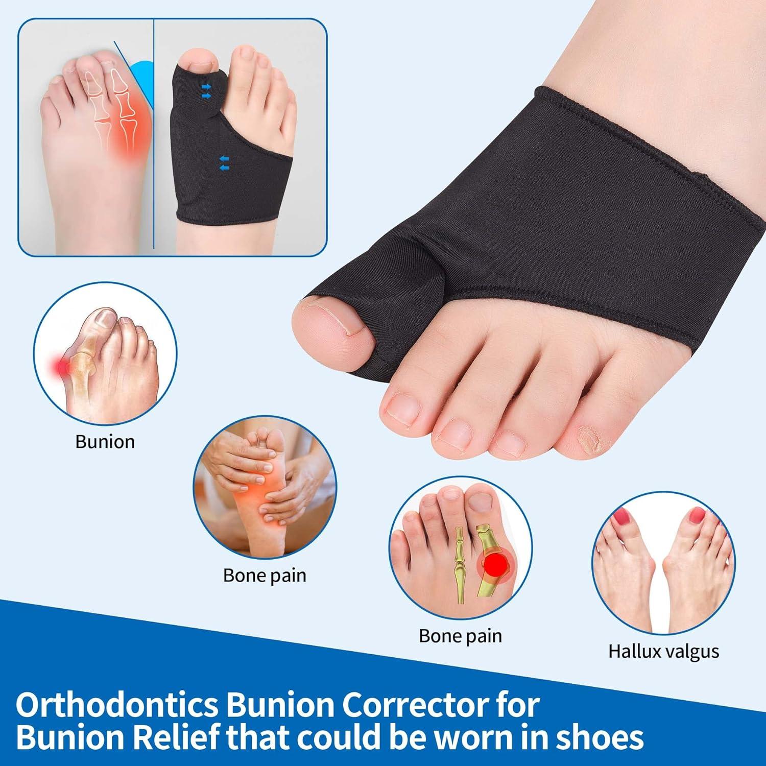 Bunion Corrector & Relief Sleeves - Orthopedic Splint with Silicone Pad ...