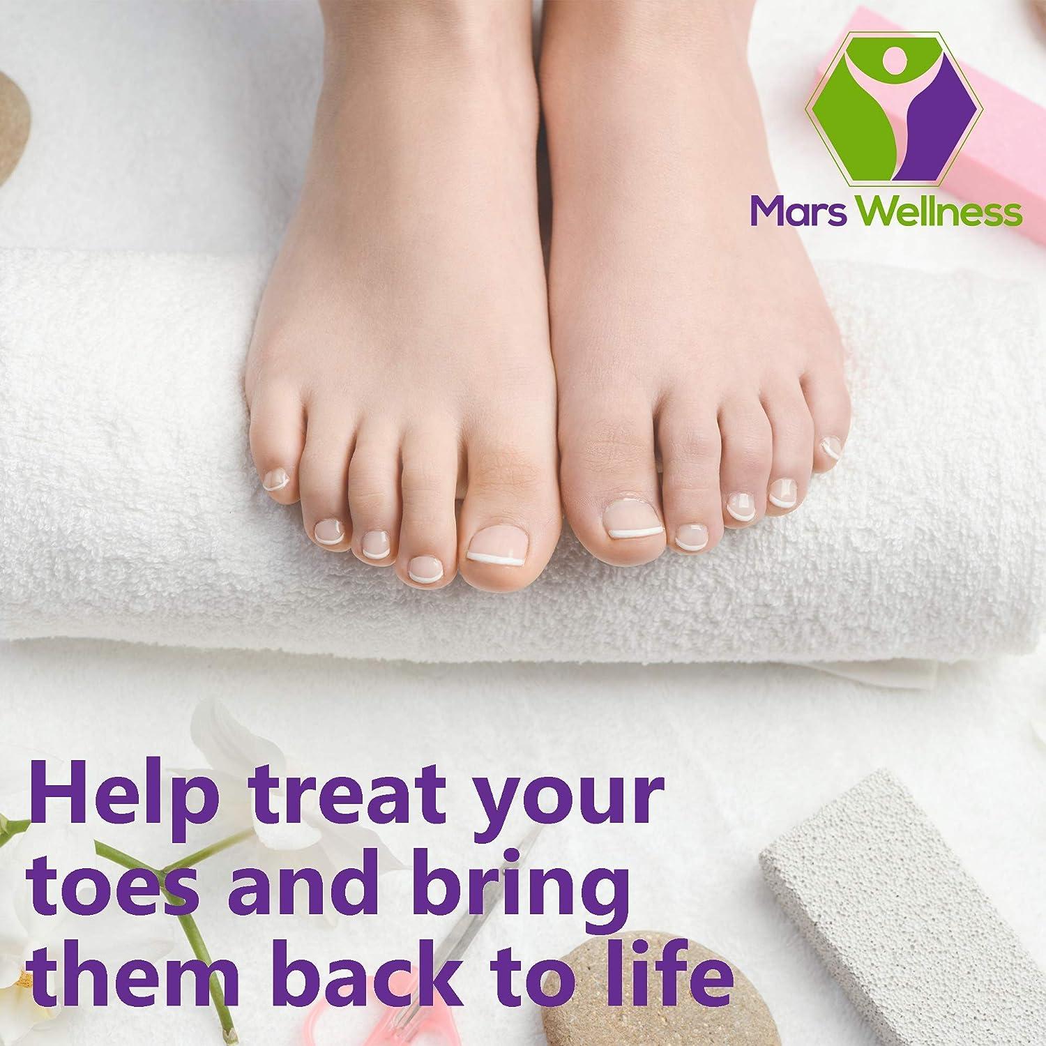 Mars Wellness Gel Toe Separators - Toe Straightener Spacer for Bunions ...