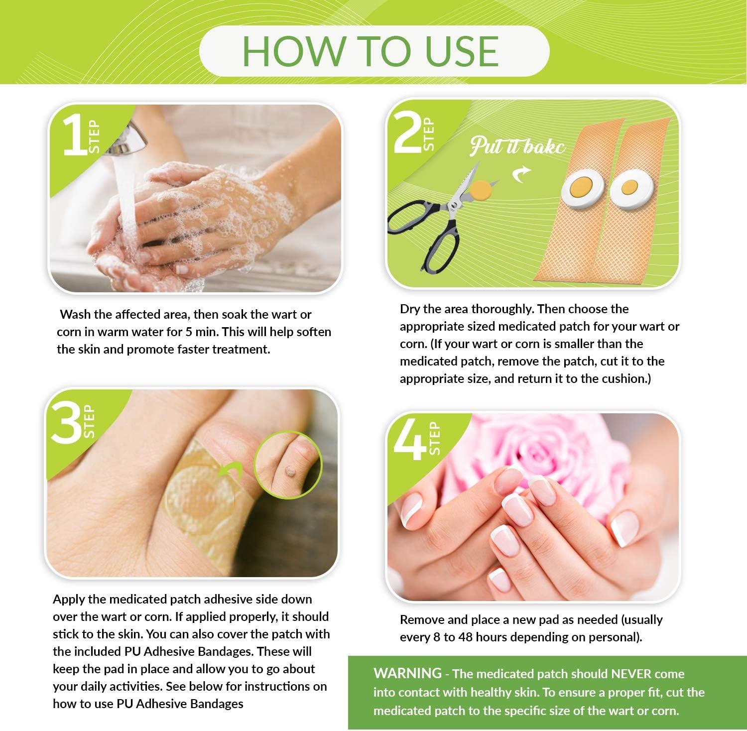 TXL Active Wart Remover | Potent Treatment for Wart Removal (30 Pads ...