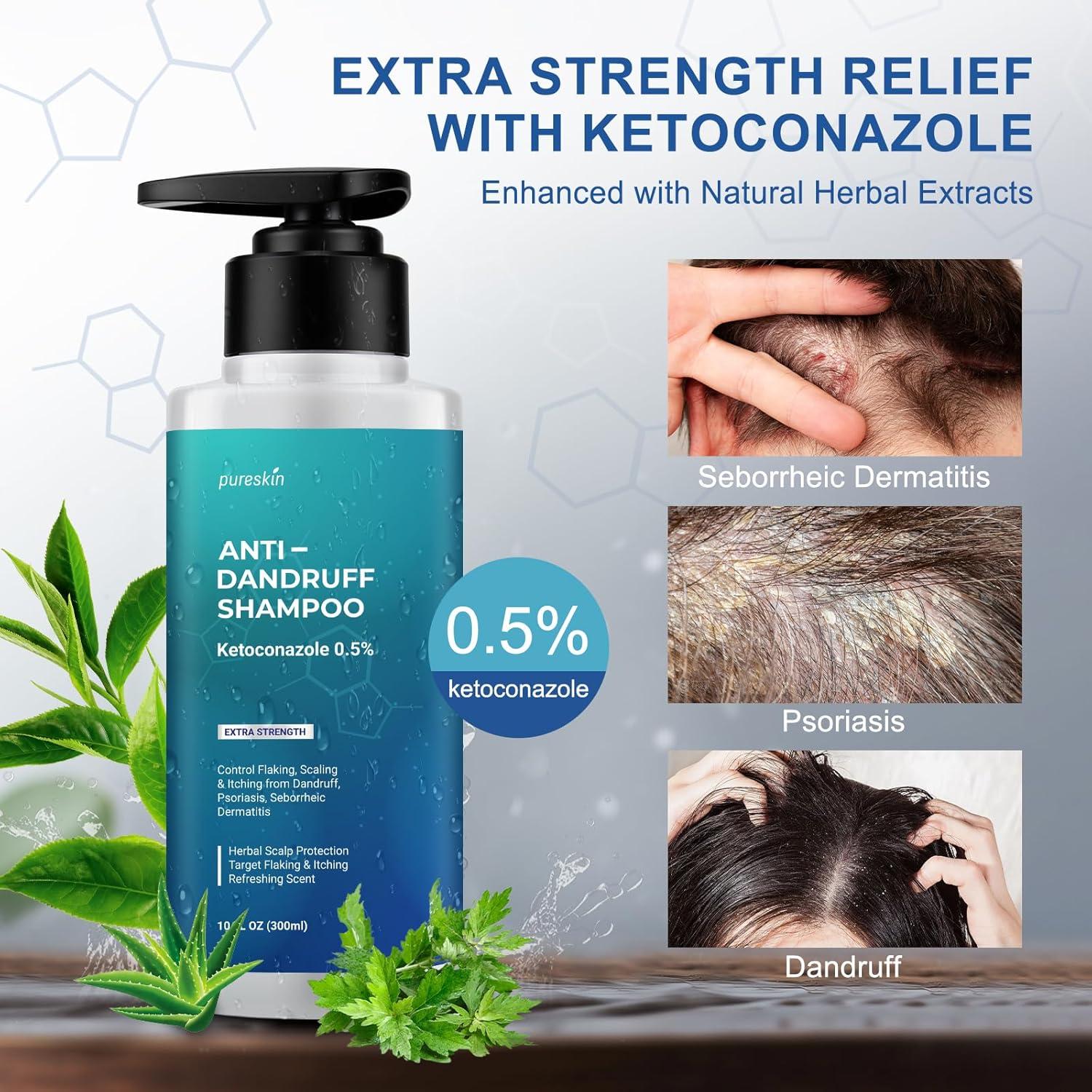 Ketoconazole Shampoo for Dandruff - Extra Strength Antifungal Treatment ...