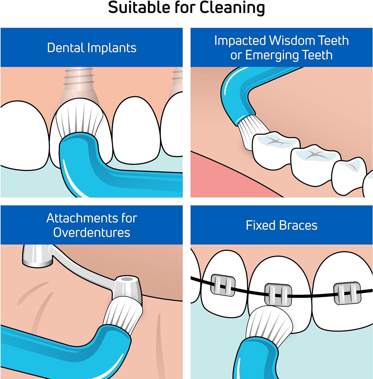 TEPE Compact Single Tuft Brush for Braces, Gum Line, and Implants ...