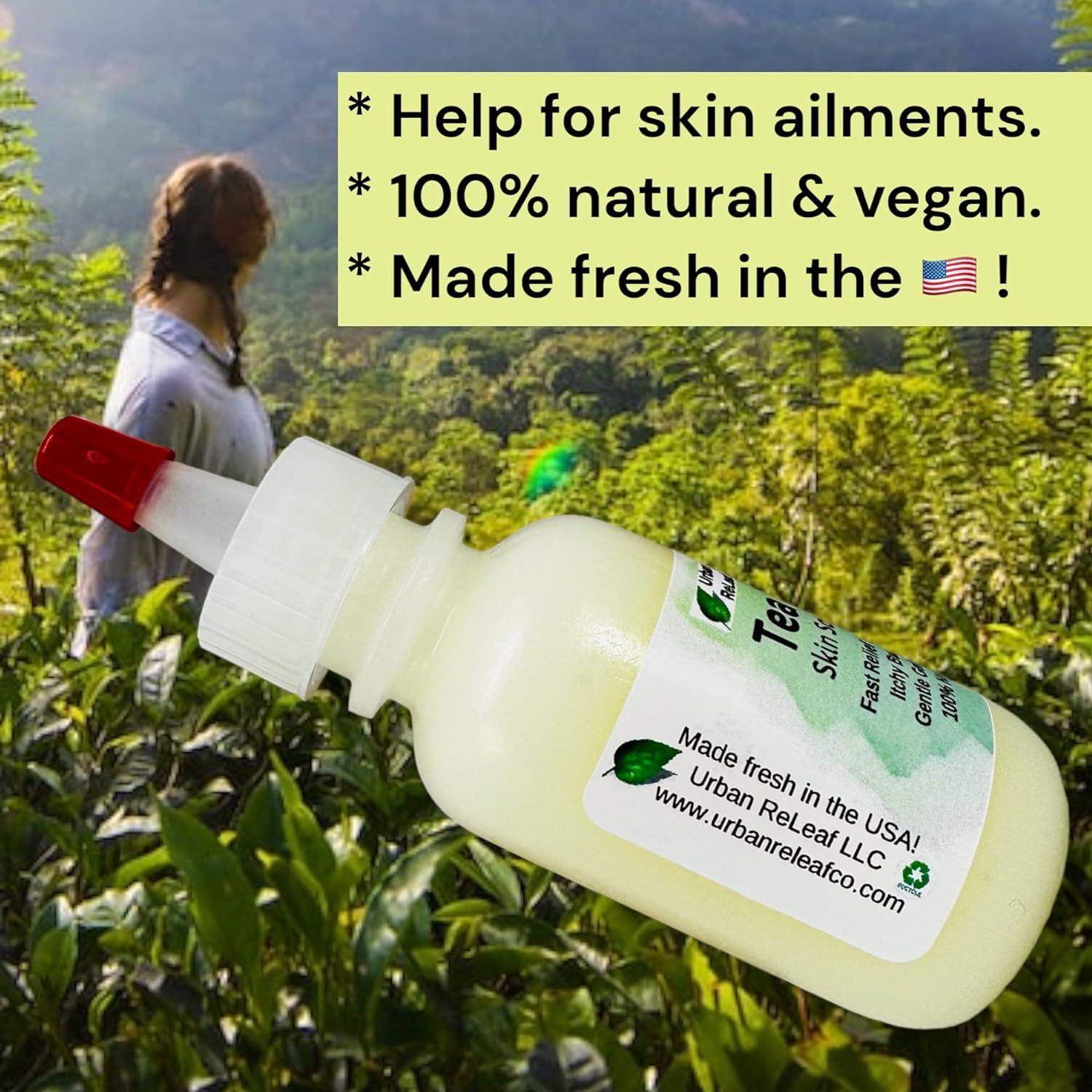 Urban ReLeaf Tea Tree Skin Soothing Gel - Fast Relief for Irritated ...