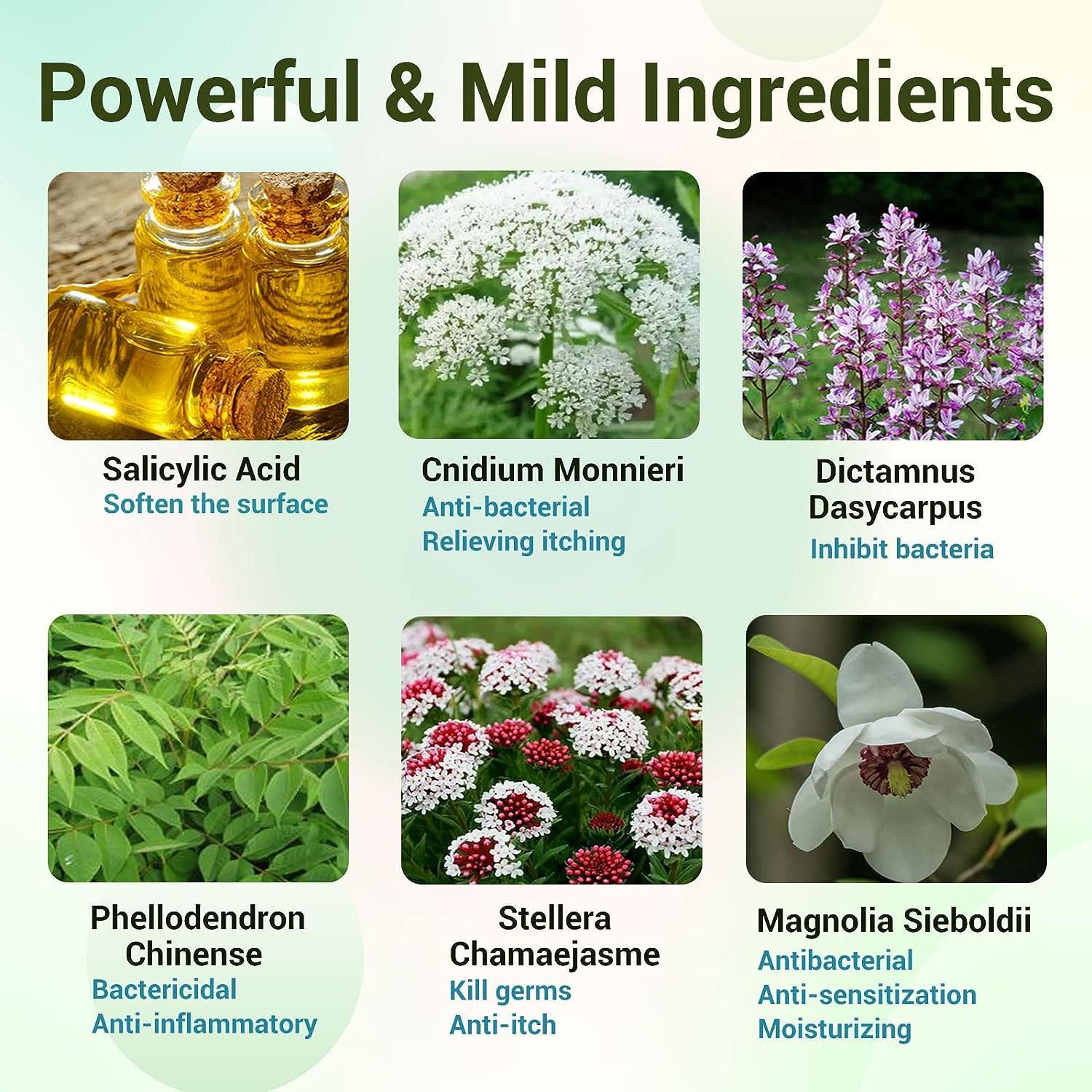 LMNOOP Psoriasis Cream - Maximum Strength Treatment for Psoriasis ...