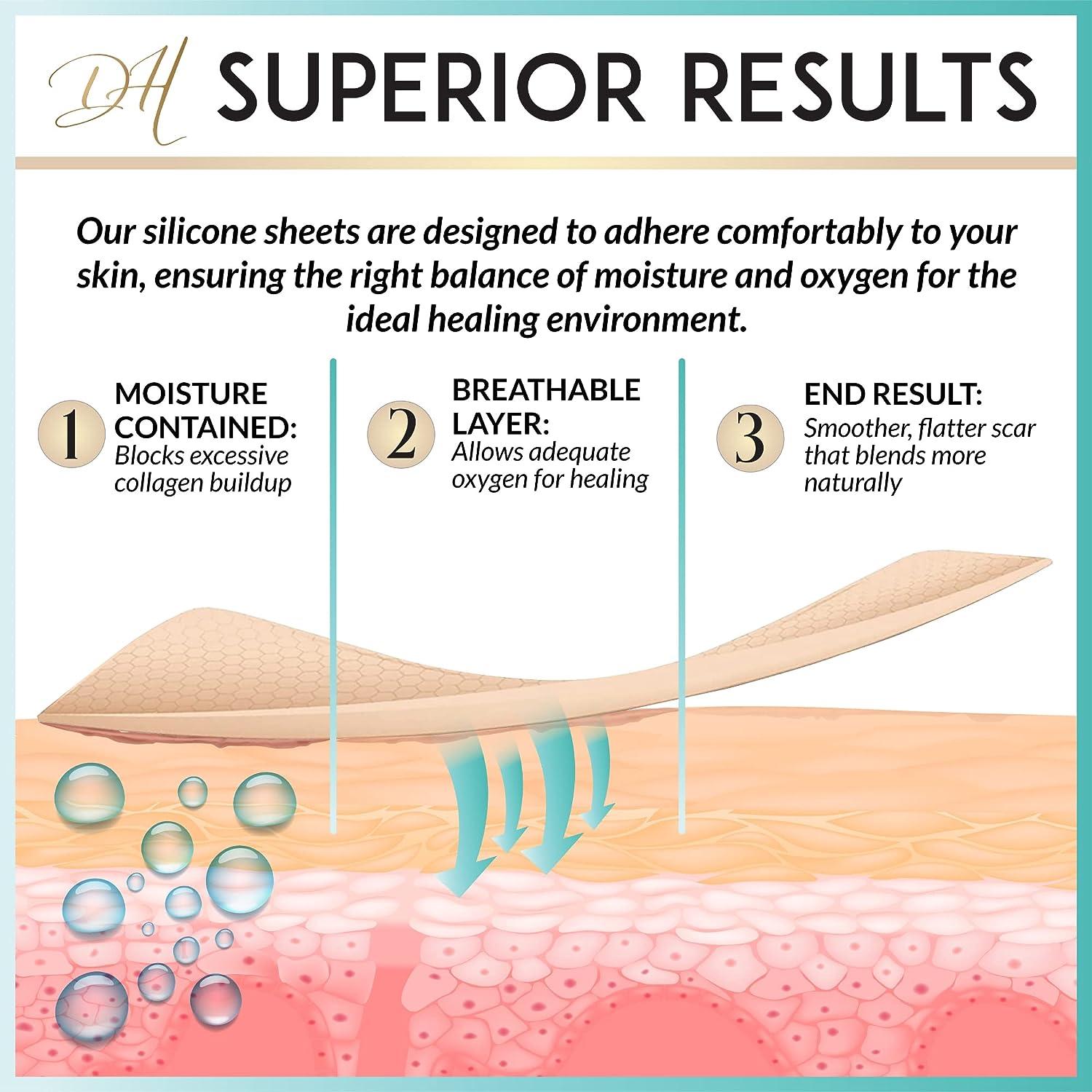 Diamond Hills Silicone Scar Removal Sheets - 4 Strips 5.9x1.57 - Fade ...