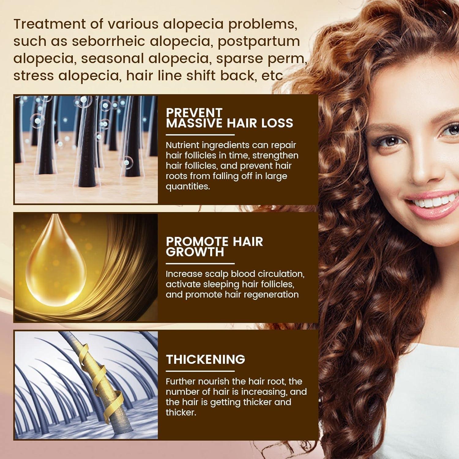 5% Biotin Minoxidil Hair Growth Oil 5% Minoxidil for Men and Women Hair ... 5% Biotin Minoxidil Hair Growth Oil 5% Minoxidil for Men and Women Hair ...