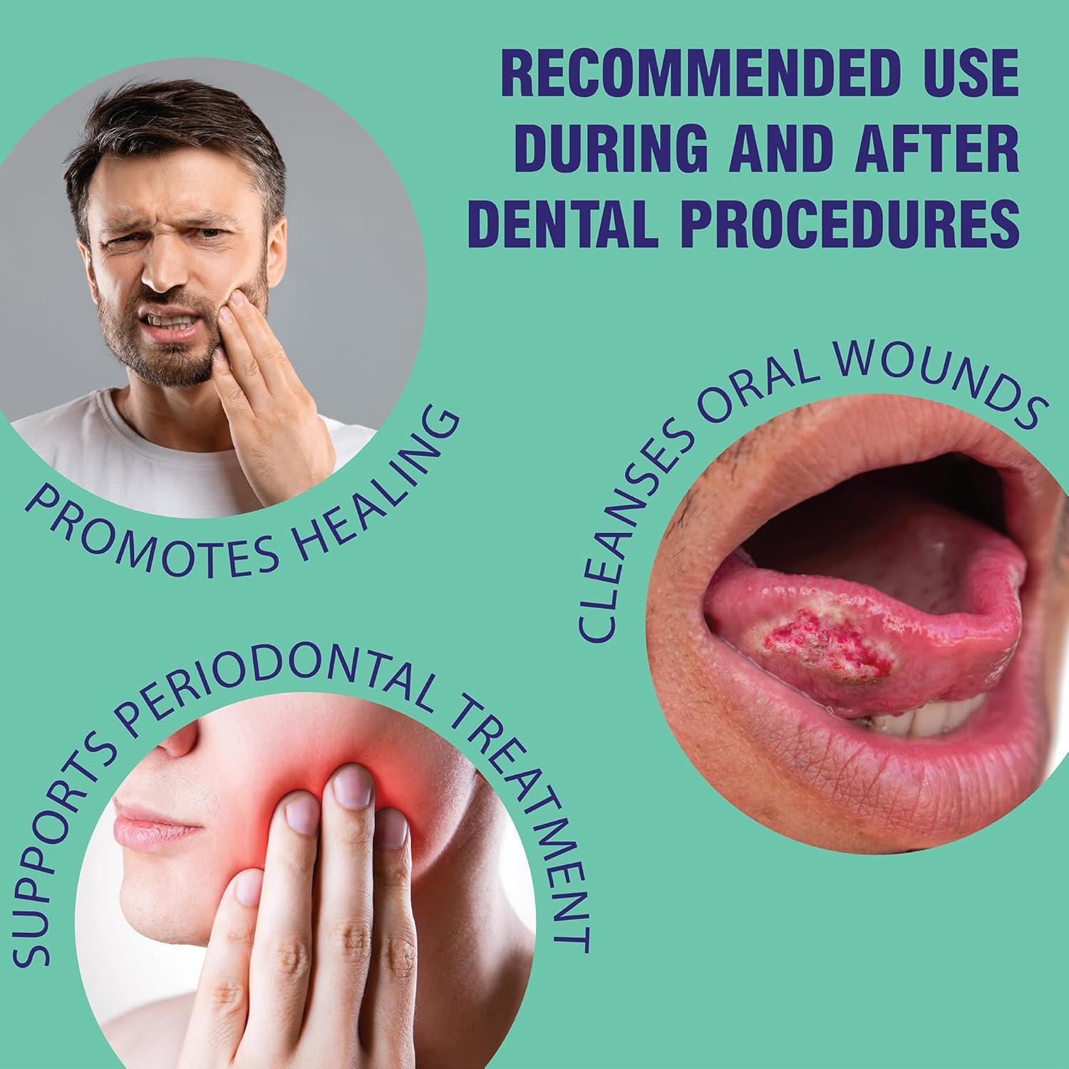 Perio Rinse with Hypochlorous Acid - Alcohol-Free Mouth Cleanser for ...