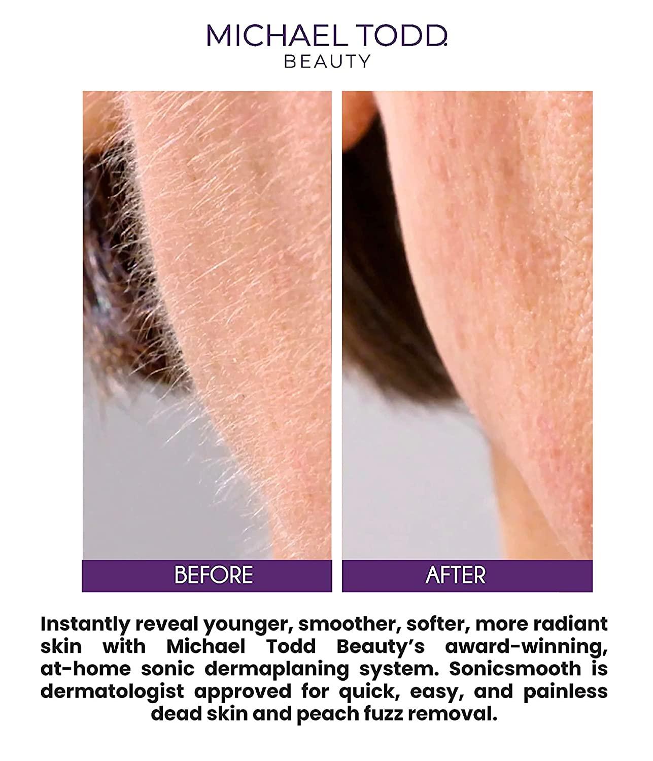 Michael Todd Beauty Sonicsmooth: 2-in-1 Dermaplaning Tool for Women ...