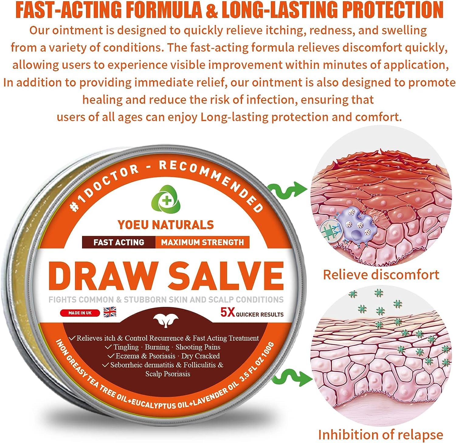 Multi-Purpose Skin Relief Cream | Treat Heat Rash, Jock Itch, Tinea ...