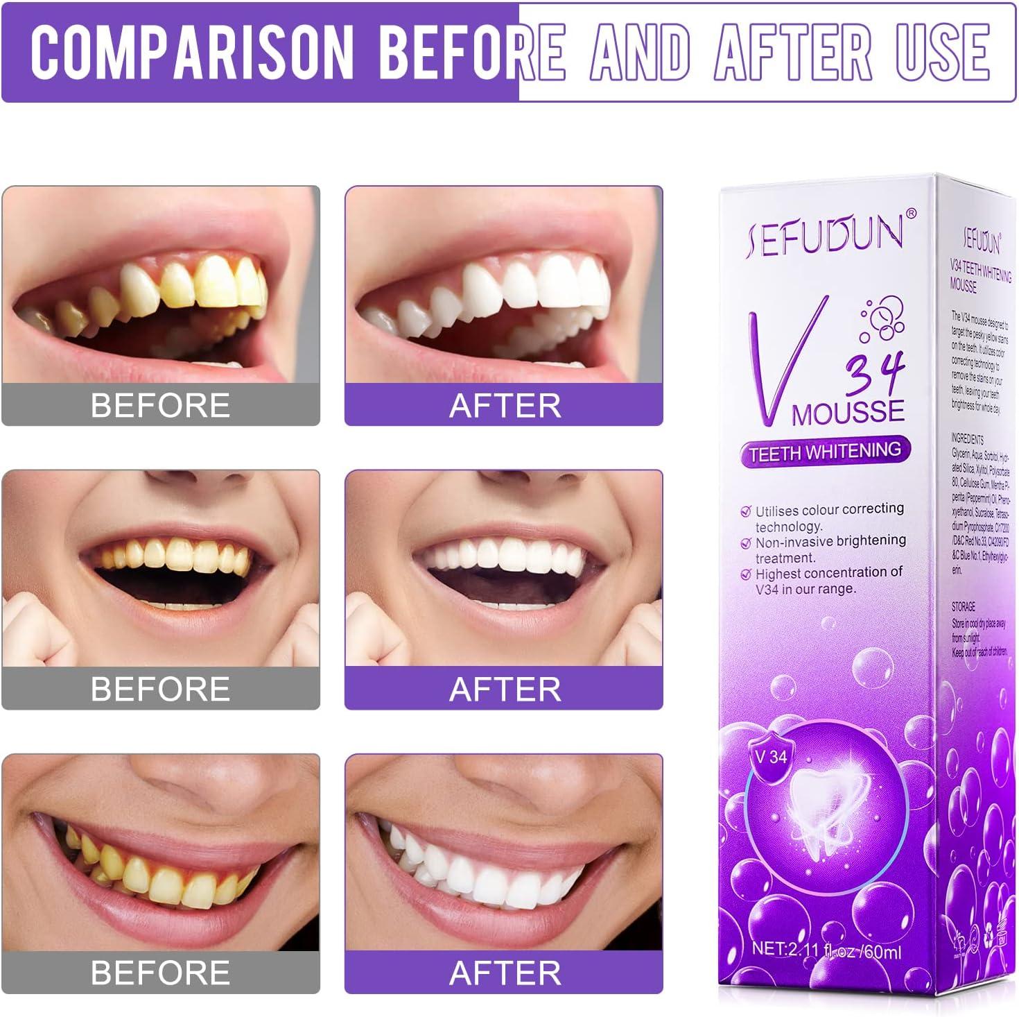 Purple Teeth Whitening Toothpaste | V34 for Deep Stain Removal & White ...